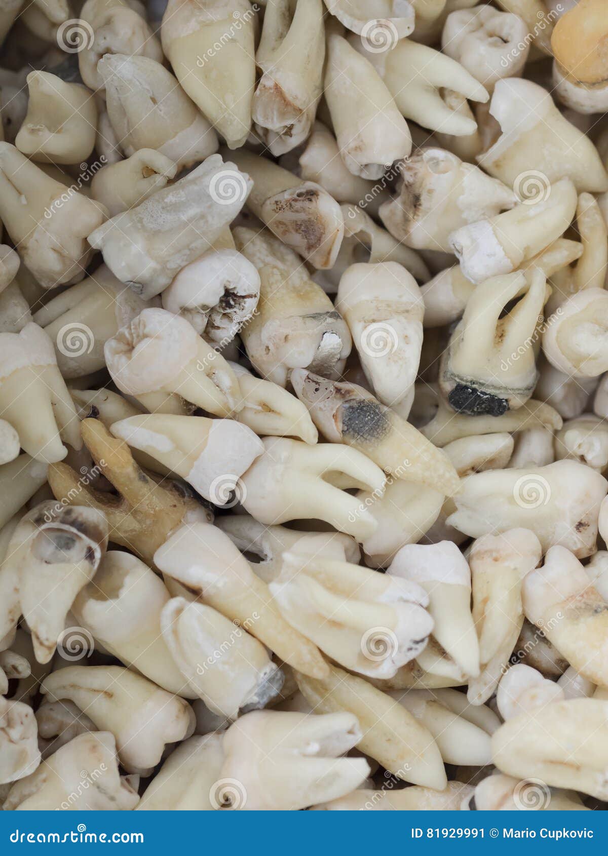 Extracted teeth stock image. Image of dentistry, anatomy - 81929991