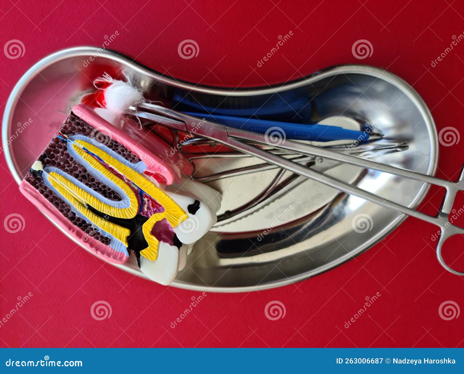 Extracted Tooth with Caries Anatomy. Treatment and Extraction of Teeth ...