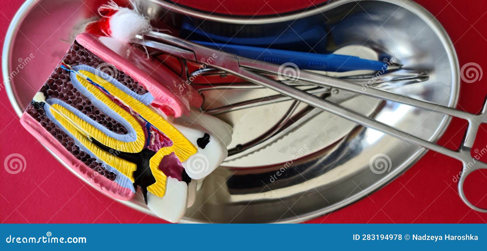 Extracted Tooth with Caries Anatomy. Treatment and Extraction of Teeth ...