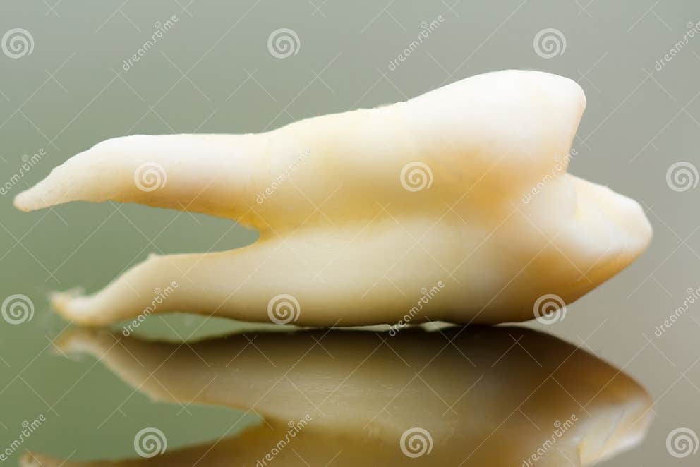 Extracted Tooth with Strange, Curved Root Stock Photo - Image of white ...
