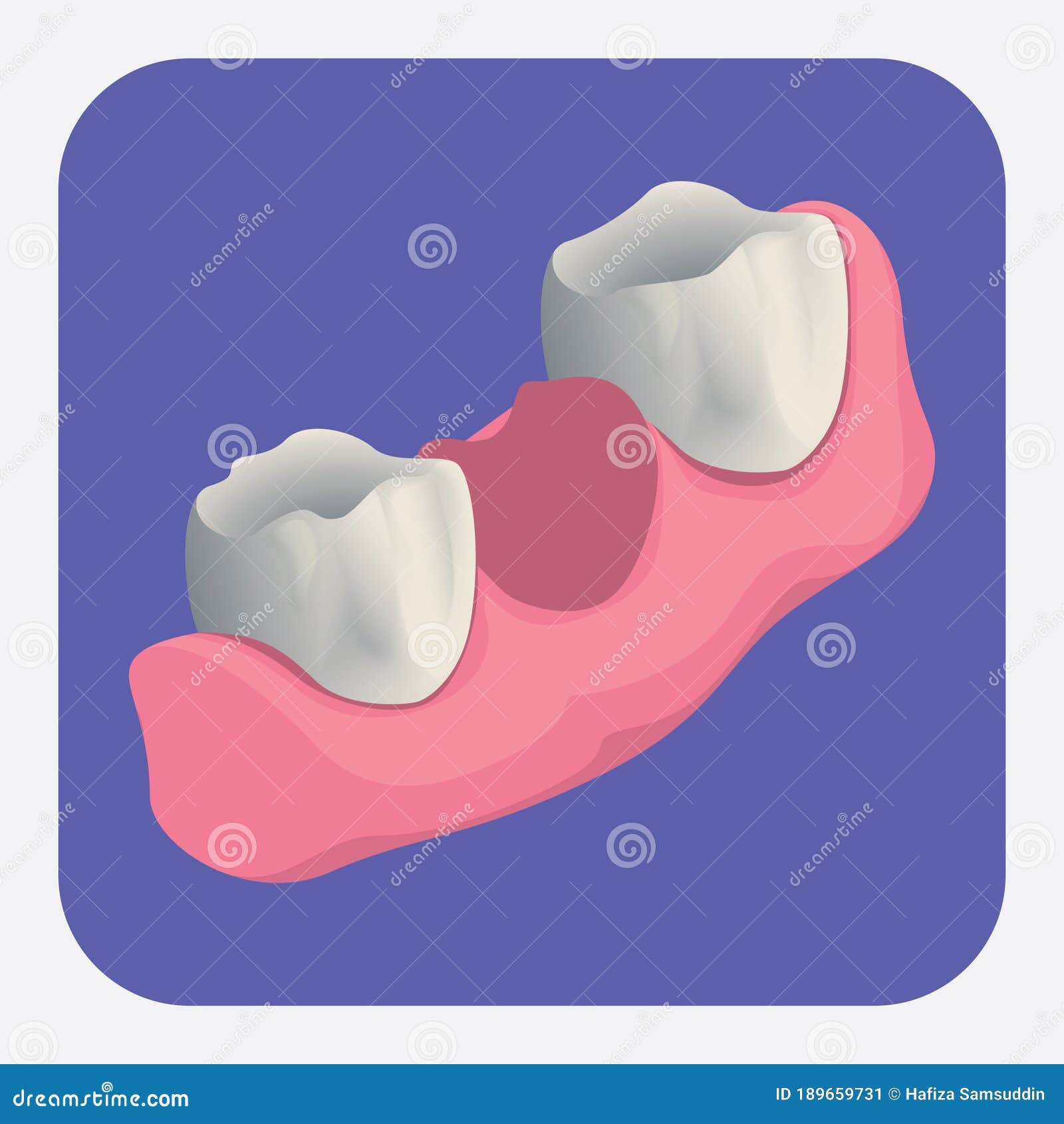 Extracted Tooth. Vector Illustration Decorative Design | CartoonDealer ...