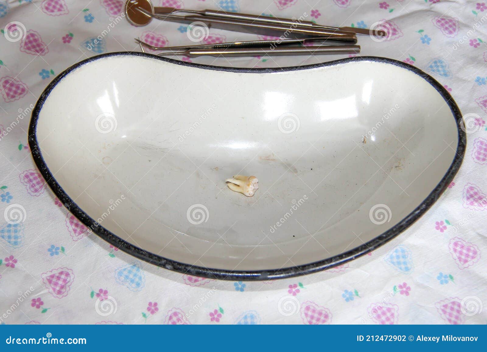 Extracted Wisdom Teeth On A Medical Tray Table With Dental Tools And ...