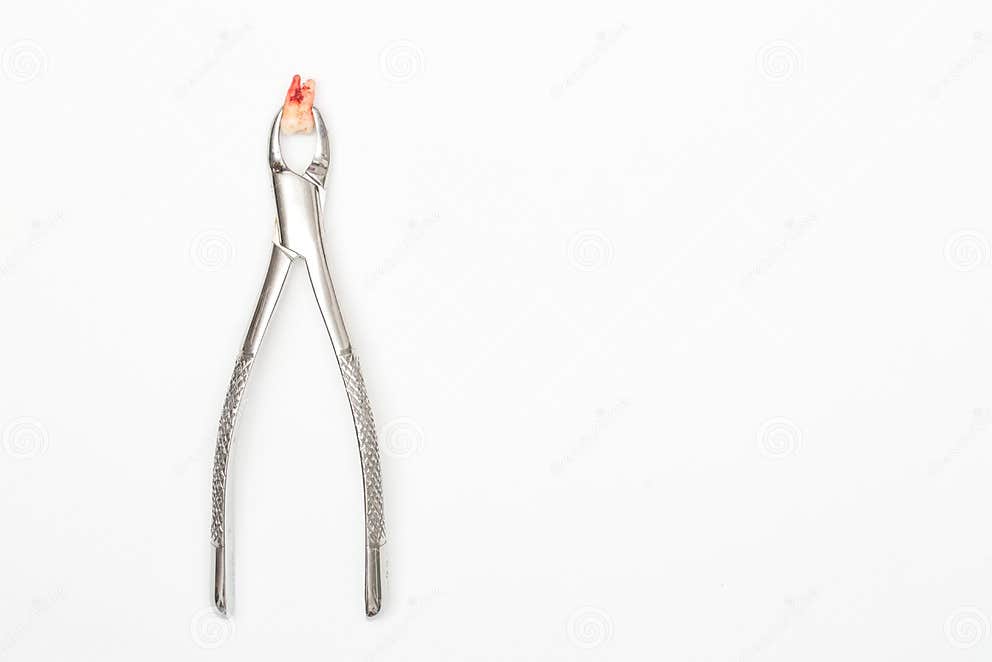 Extraction of Tooth with Dental Tools Stock Photo - Image of clamp ...