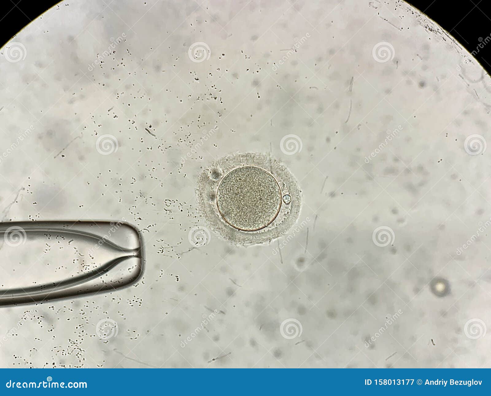 View through Microscope at in Vitro Fertilization Process Stock Image ...