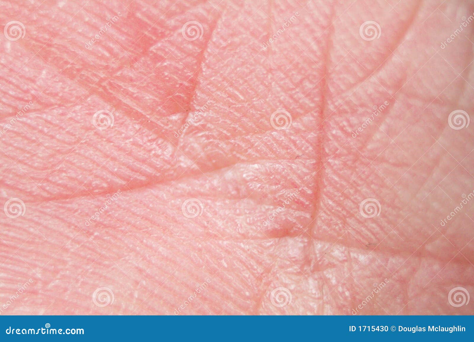 An Extreme Close Up of My Palm Stock Photo - Image of hand, bumps: 1715430