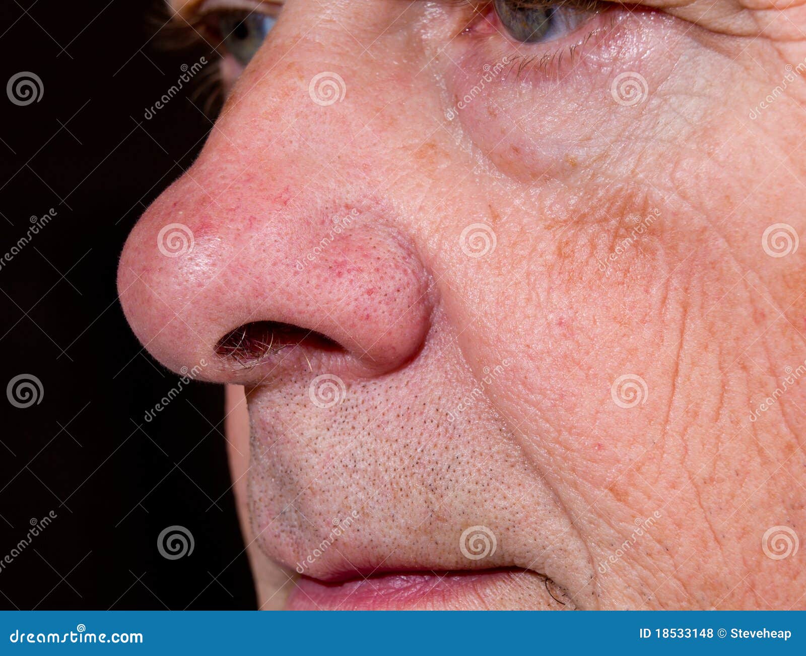 Extreme Close Up of Senior Nose in Side View Stock Photo - Image of ... Extreme Close Up of Senior Nose in Side View Stock Photo - Image of ...