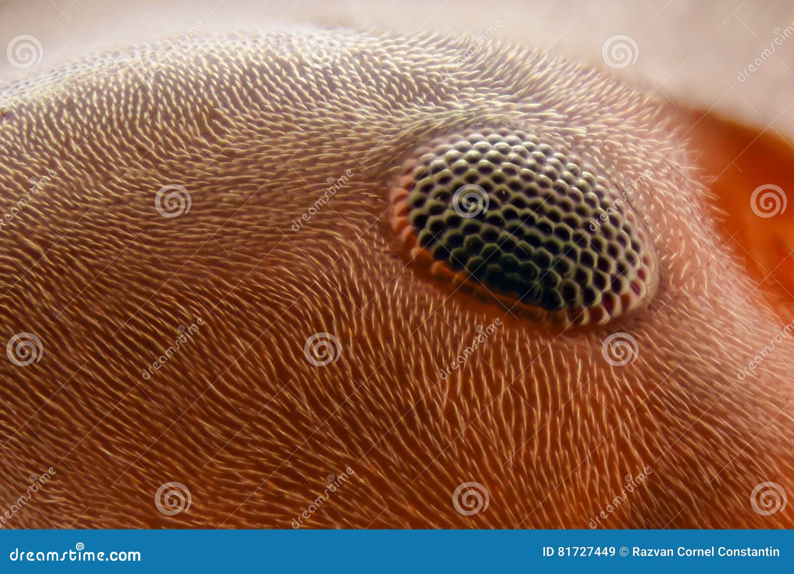 Pimple Extreme On Human Skin. Royalty-Free Stock Photography ...