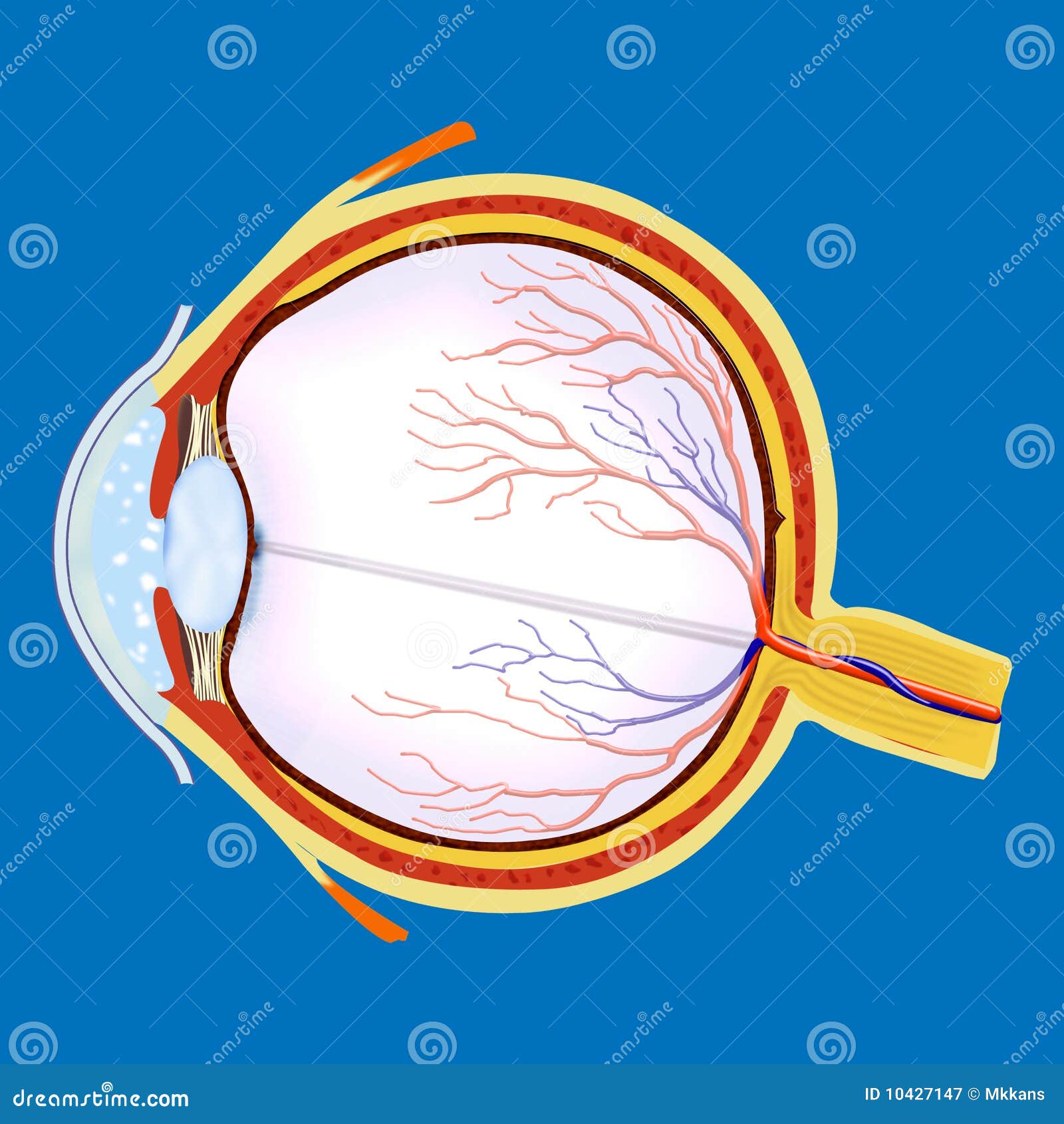 Retinal Detachment Cartoon Vector | CartoonDealer.com #28293937