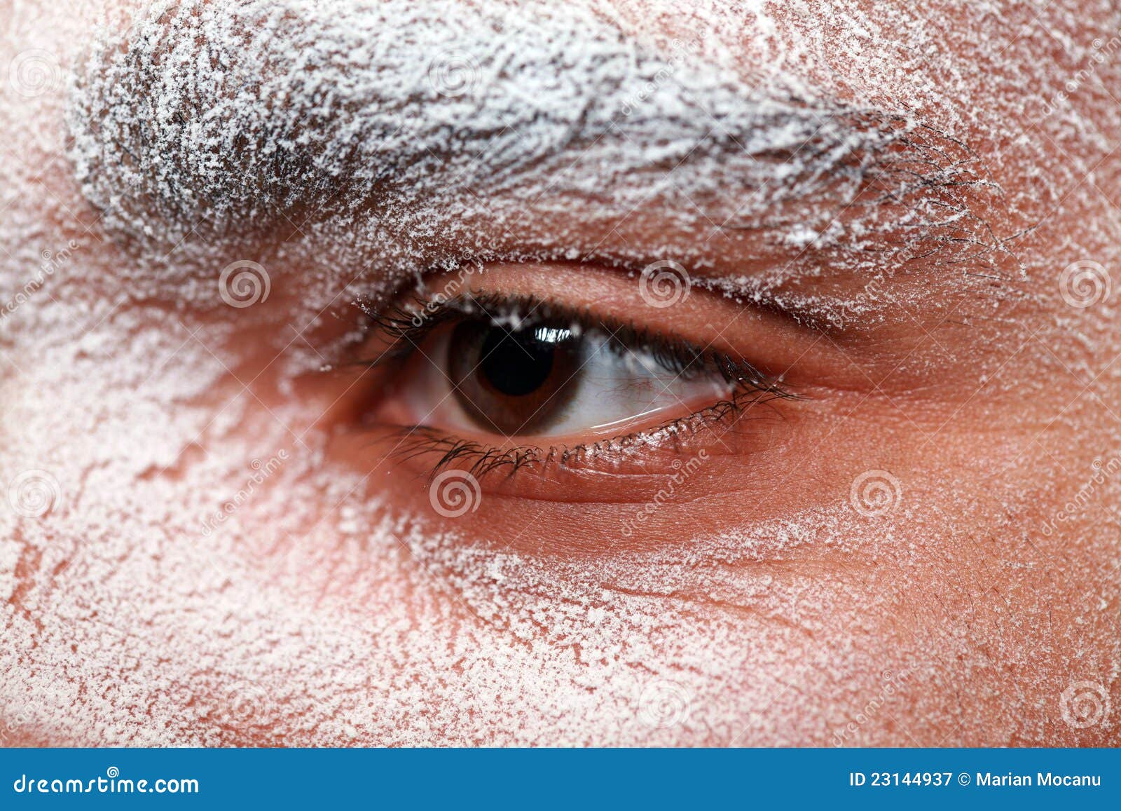 Eye stock image. Image of snow, nous, tired, painful - 23144937