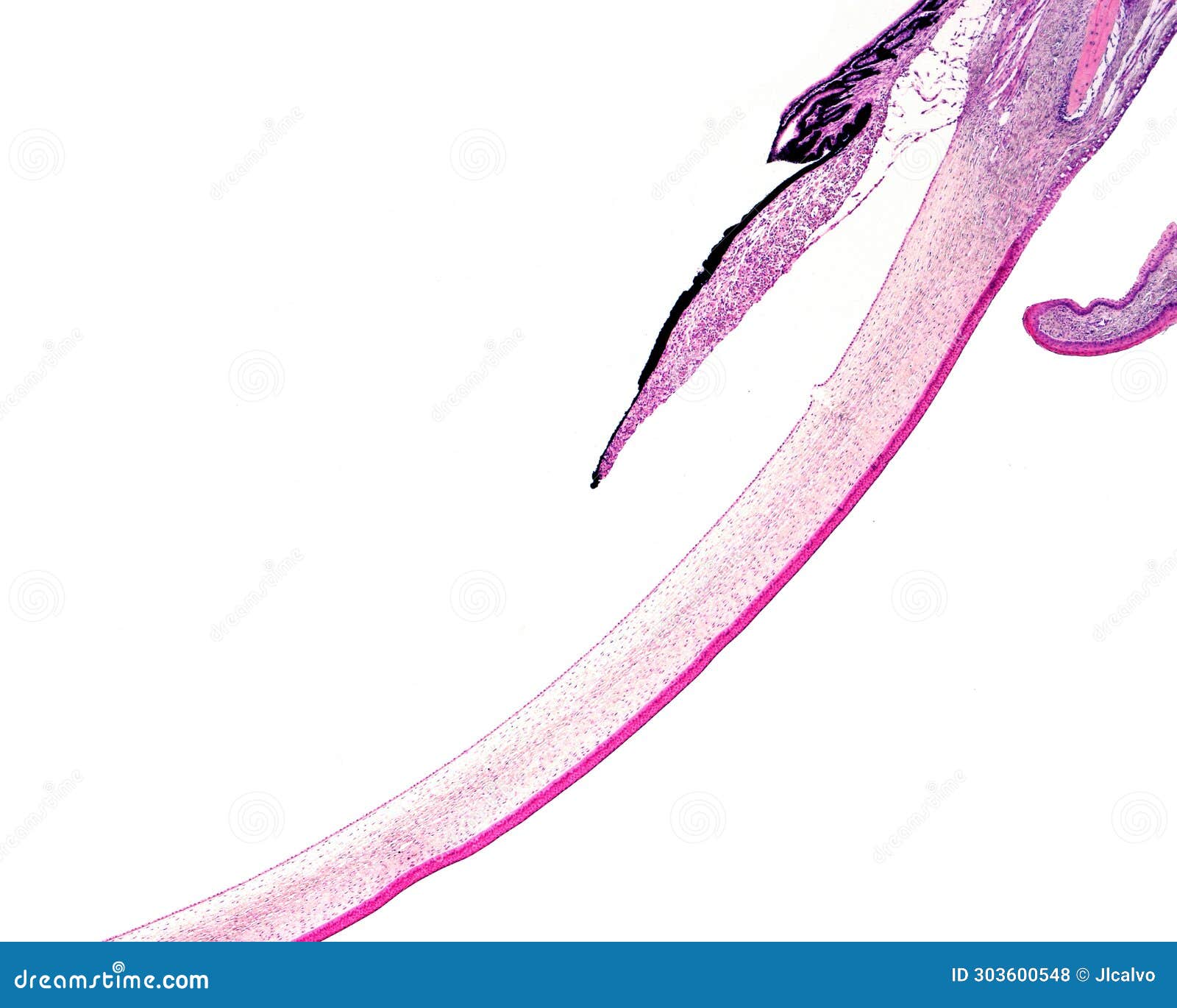 Eye. Anterior pole stock photo. Image of ciliary, microscope - 303600548