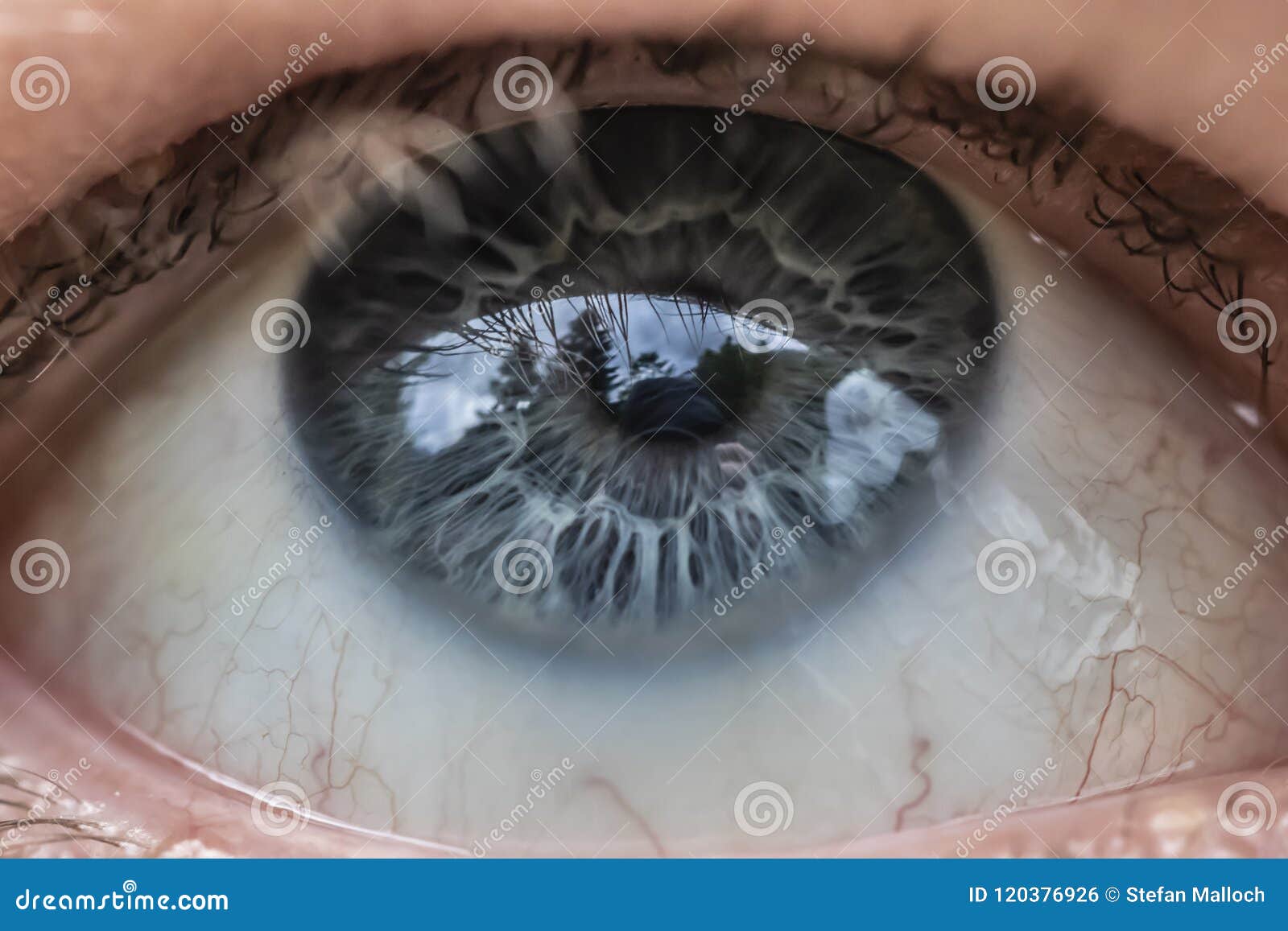 An Eye Ball Wide Open Close Up Stock Photo - Image of pupil, wide ...