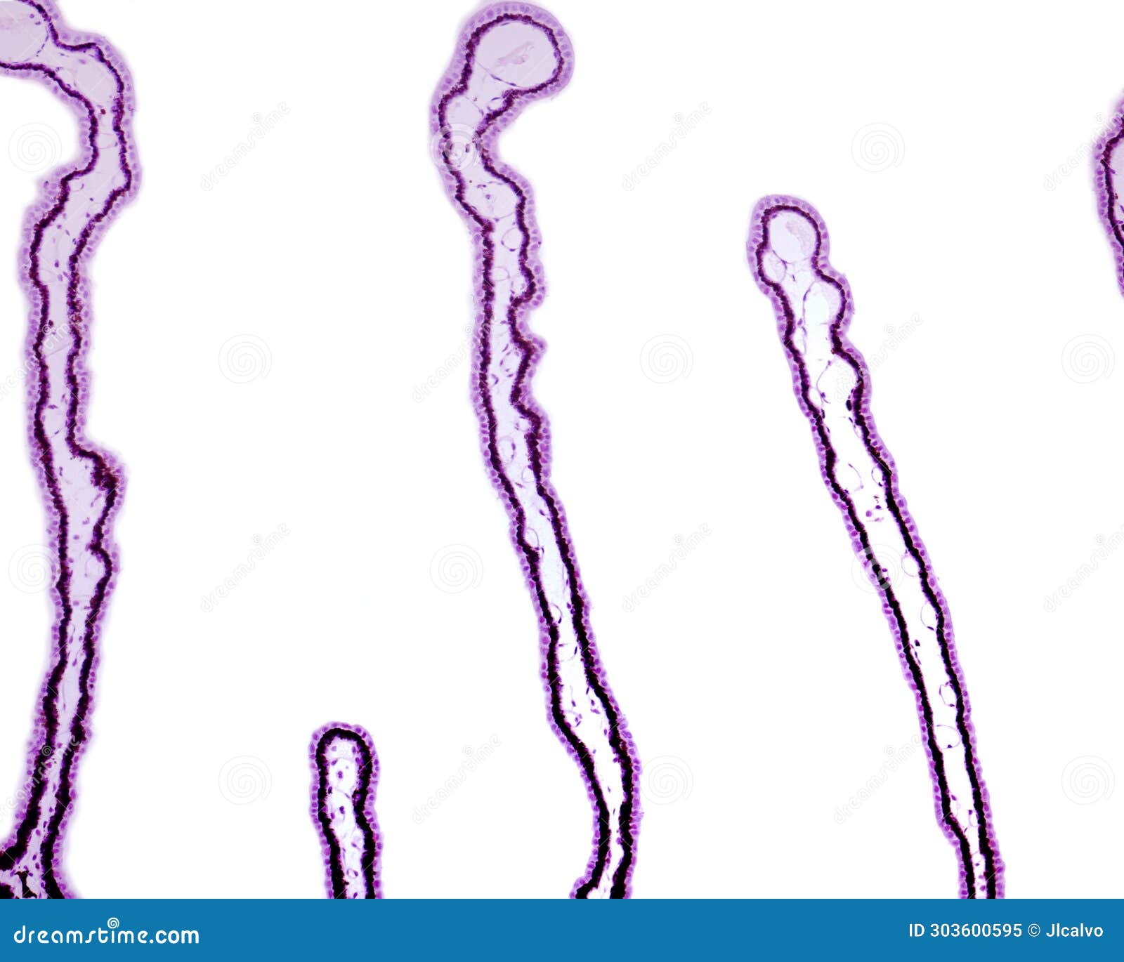 Eye. Ciliary body stock image. Image of histological - 303600595