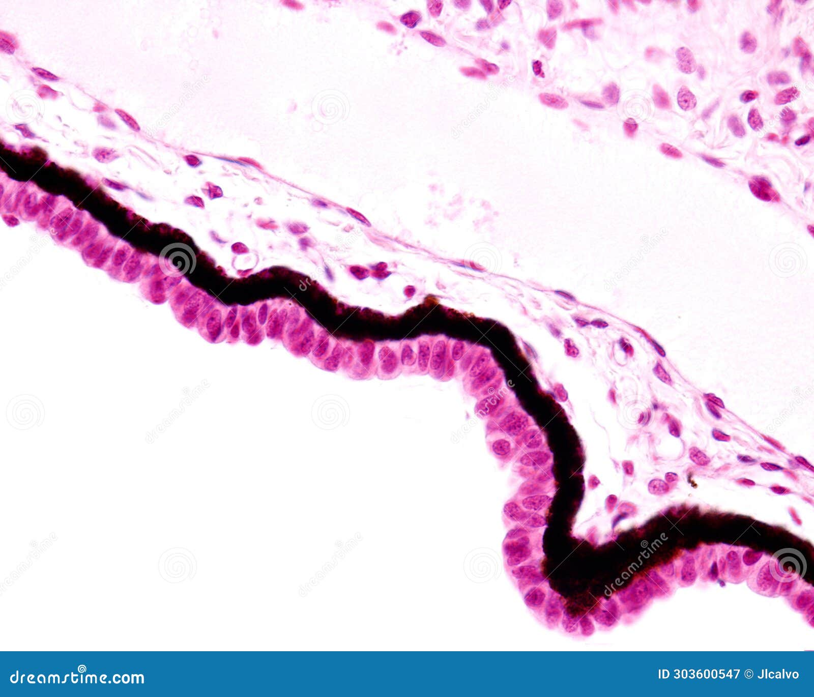 Eye. Ciliary Body Epithelium Stock Image - Image of epithelium, light ...