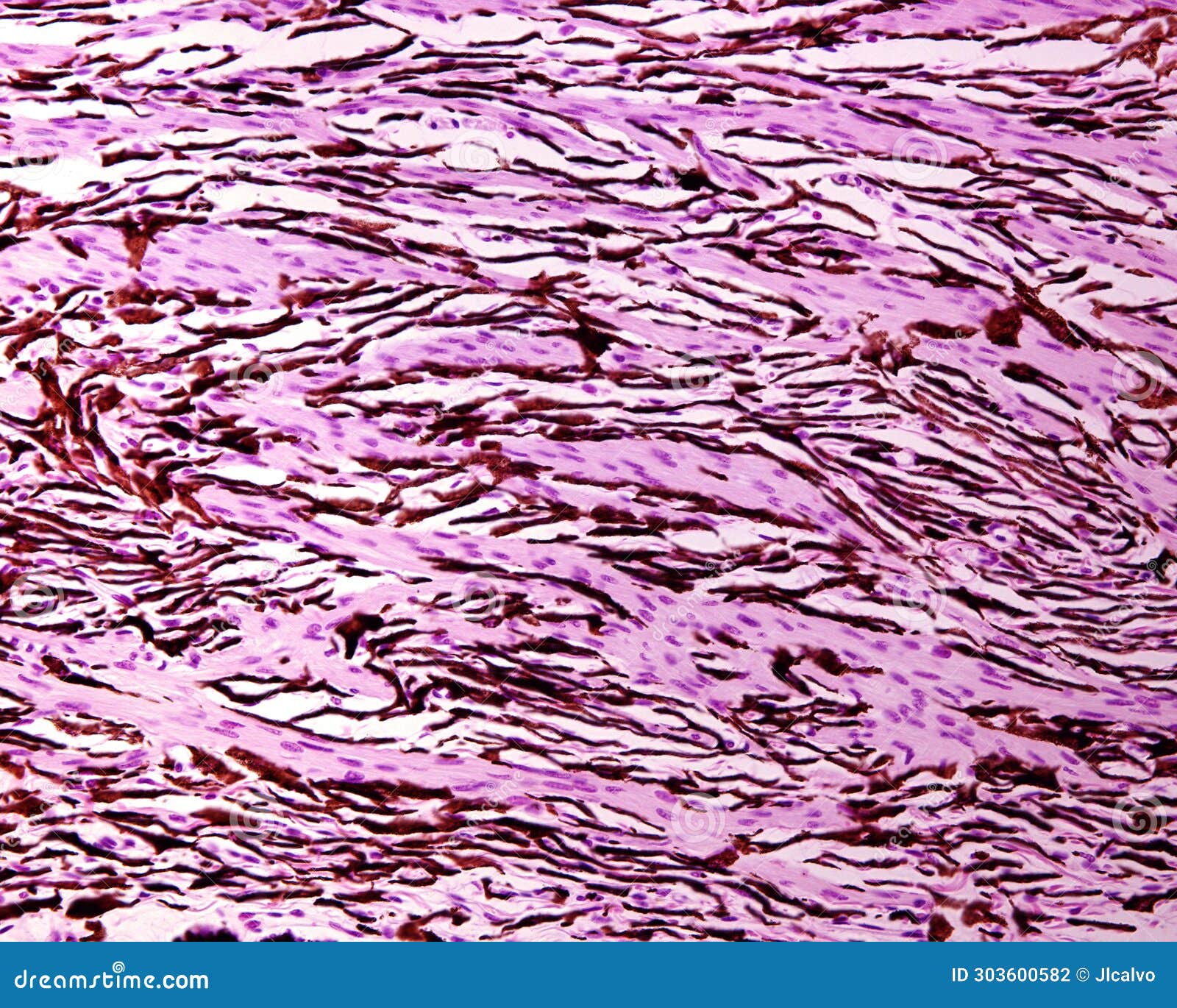 Eye. Ciliary muscle stock photo. Image of light, plicata - 303600582