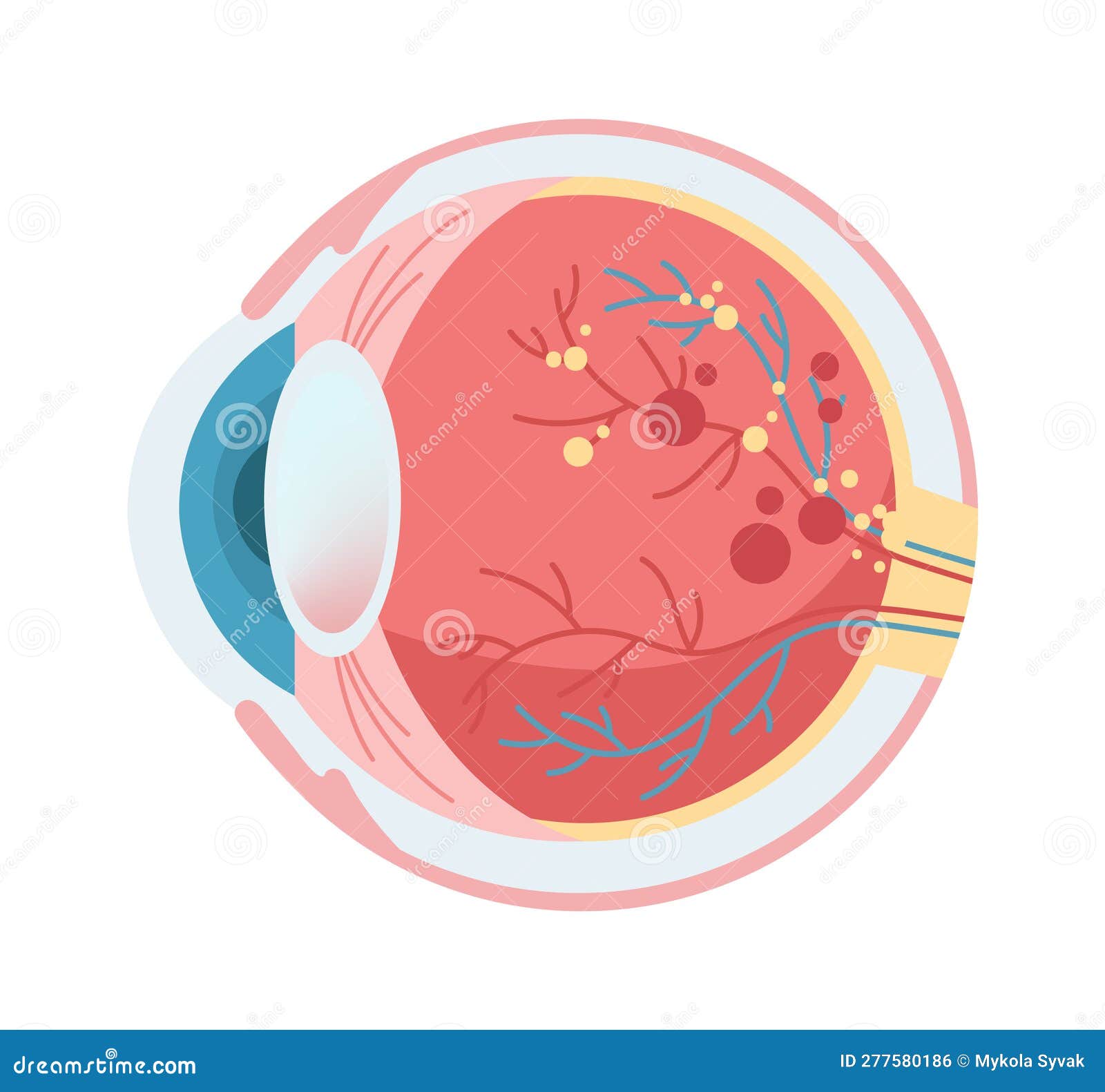 Eye Damage Disease stock vector. Illustration of patient - 277580186