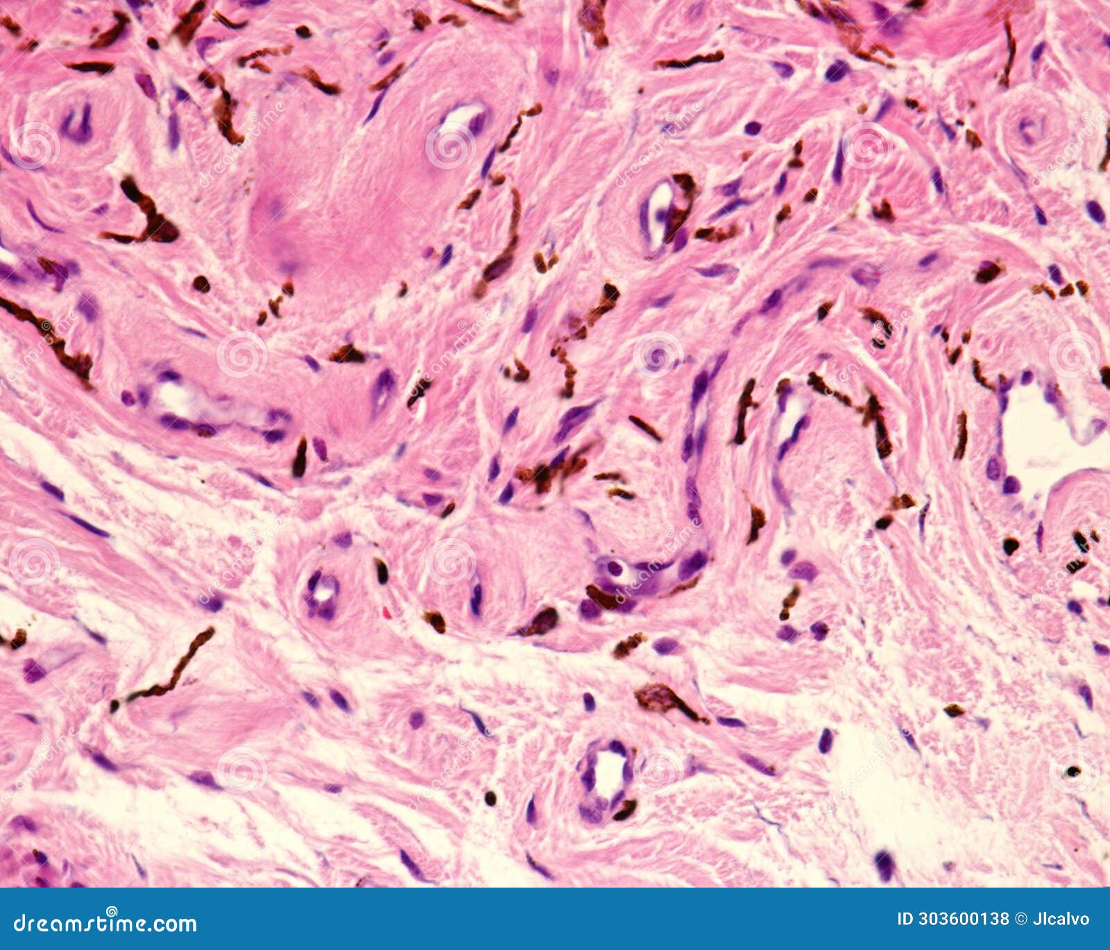 Eye. Iris stroma stock photo. Image of pigment, microscope - 303600138