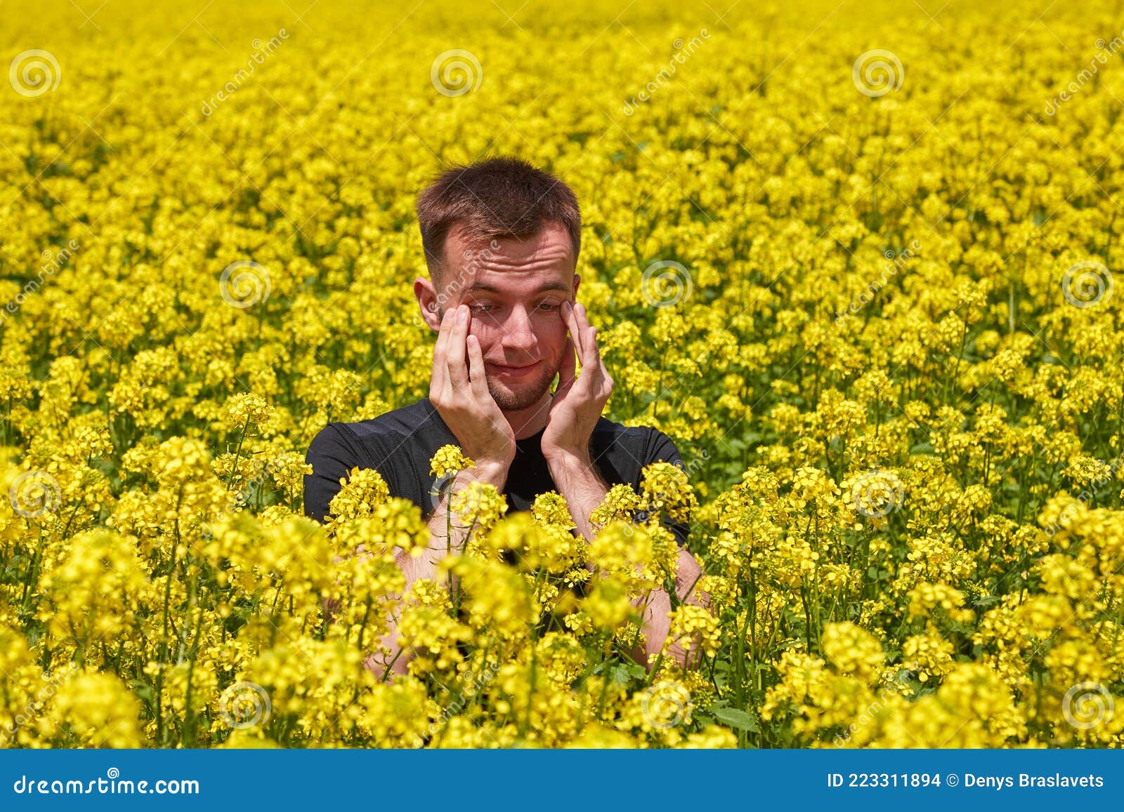 Eye Irritation and Pain Caused by Pollen Allergy Stock Photo - Image of ...