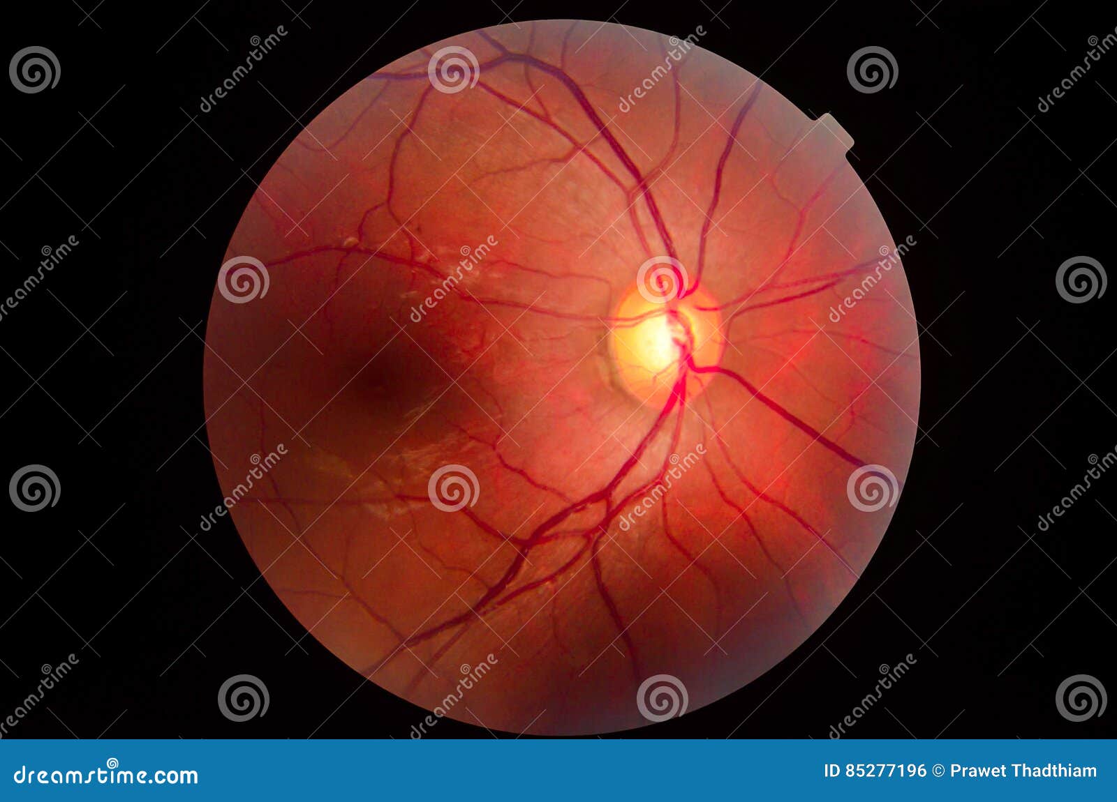 The eye of the microscope stock photo. Image of normal - 85277196