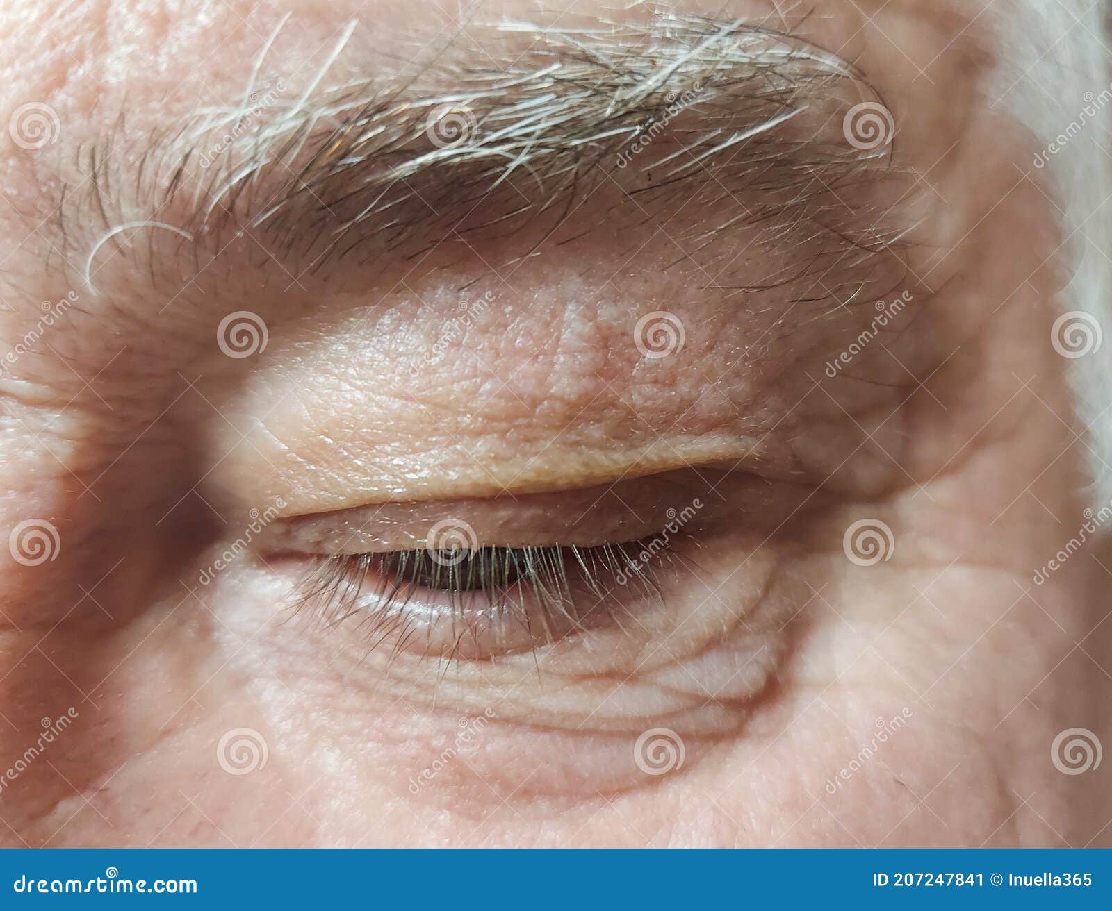 The Eye of an Old Man, the Wrinkled Face of a Gray-haired Old Man Close ...