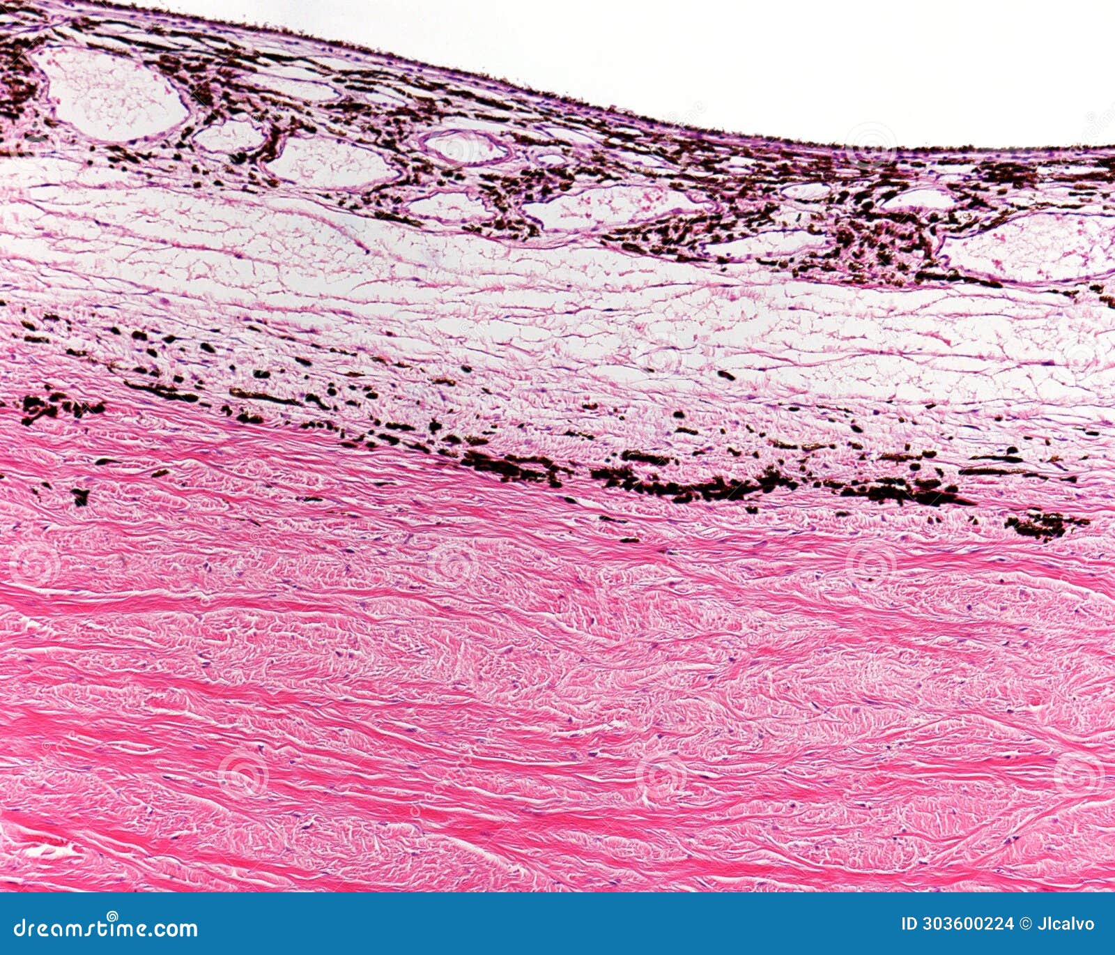 Eye. Sclera And Choroid. Lamina Fusca Royalty-Free Stock Photo ...