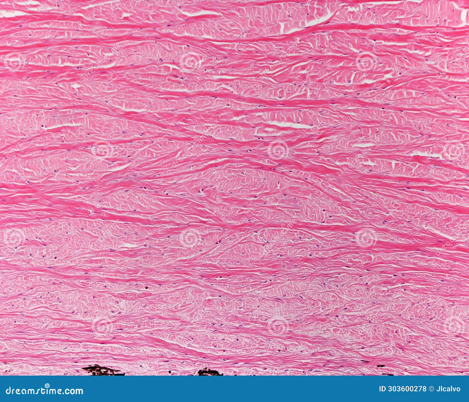 Eye. Sclera And Choroid. Lamina Fusca Stock Photography | CartoonDealer ...