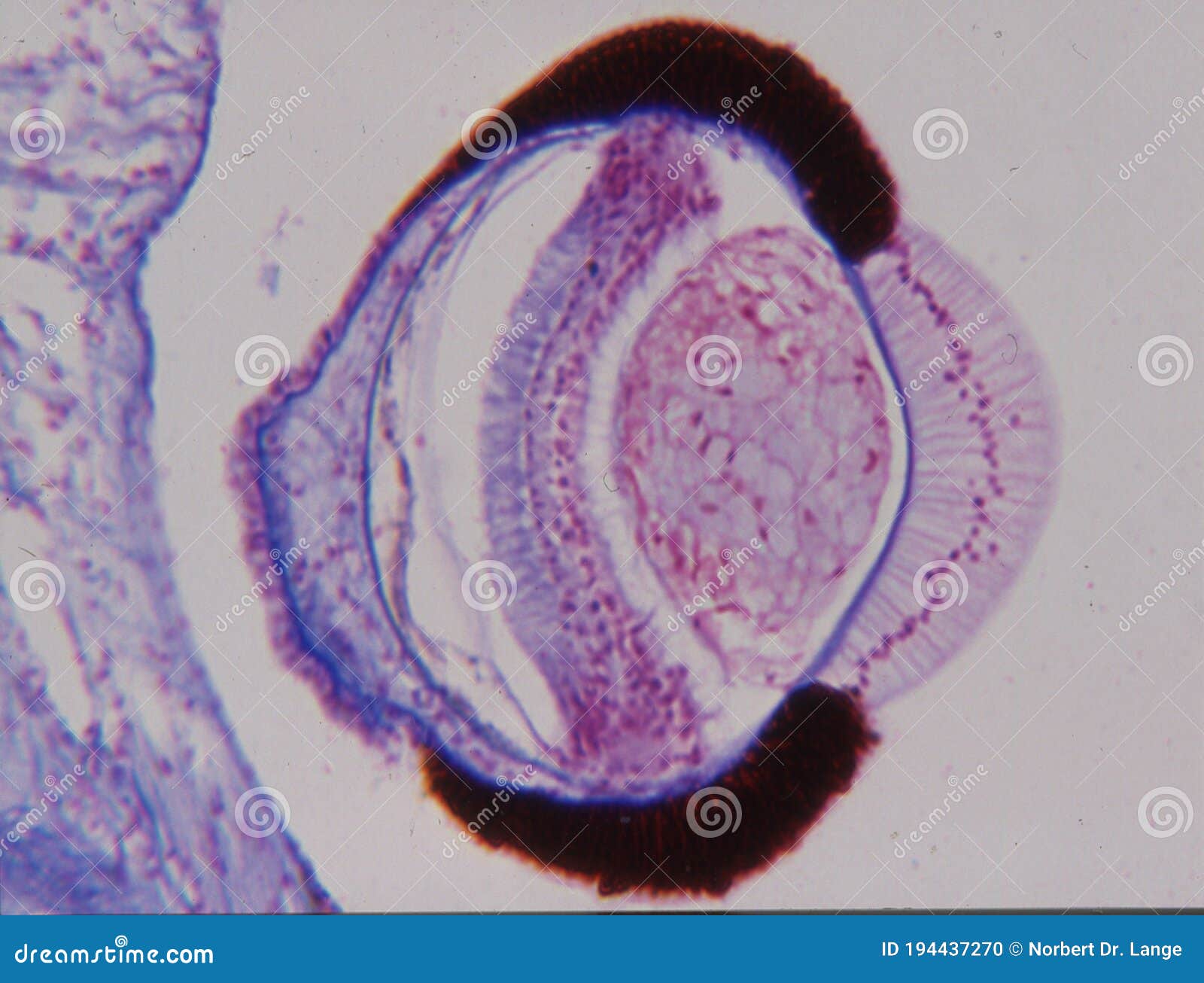Eyeball in Longitudinal Section Stock Photo - Image of thin, retina ...