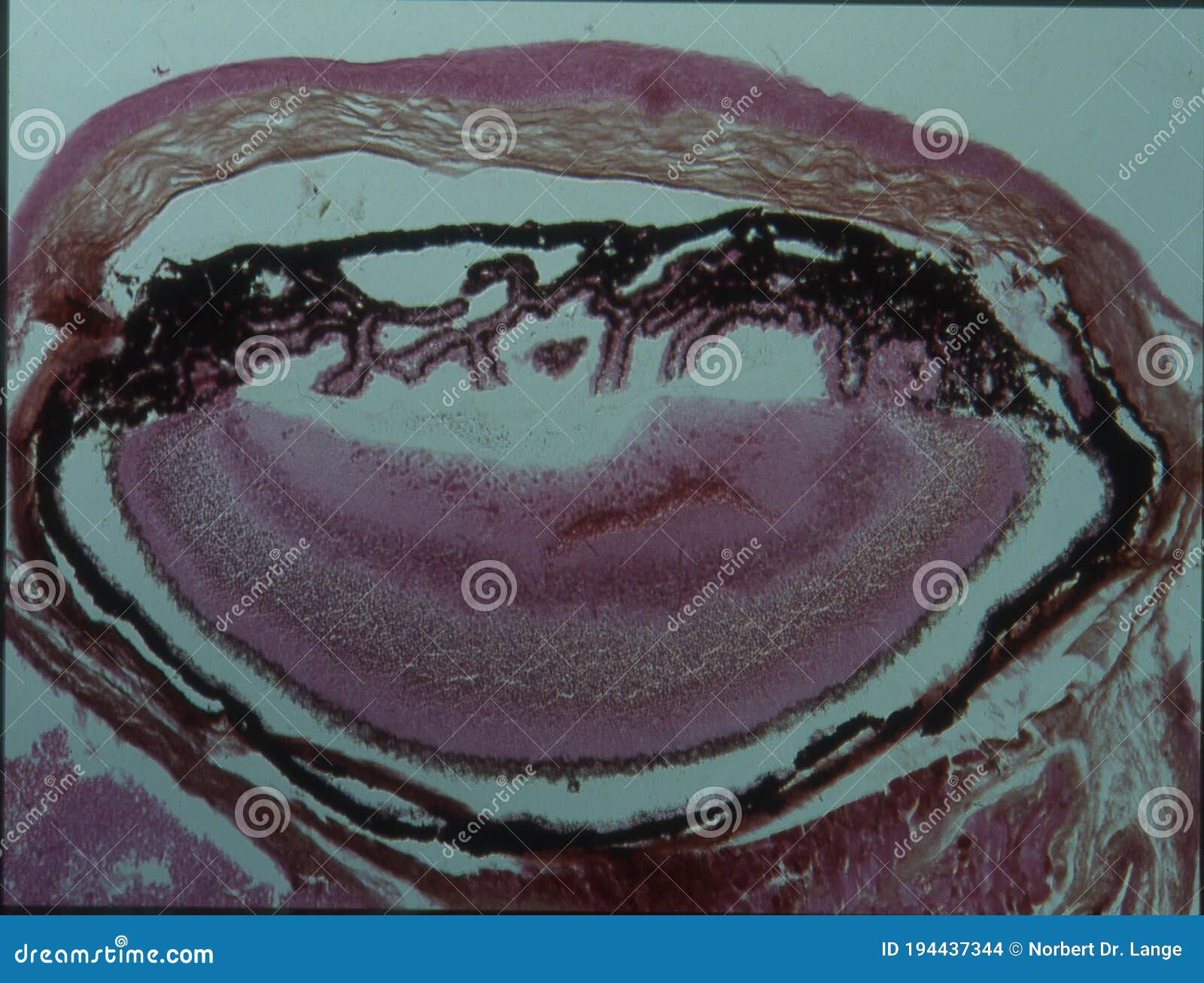 Eyeball in Longitudinal Section Stock Photo - Image of brown, optik ...