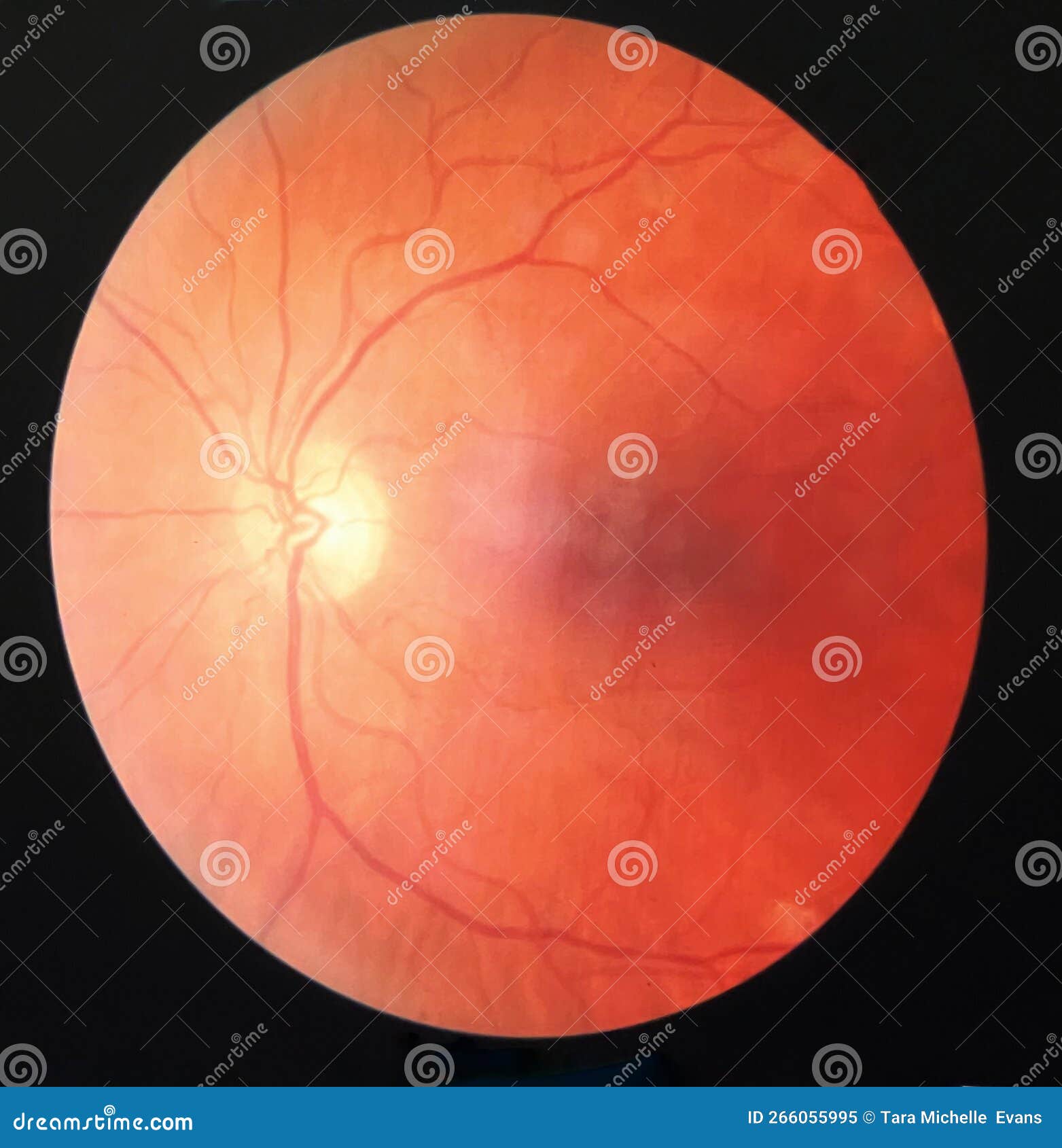 Eyeball stock image. Image of blood, viens, test, eyeball - 266055995