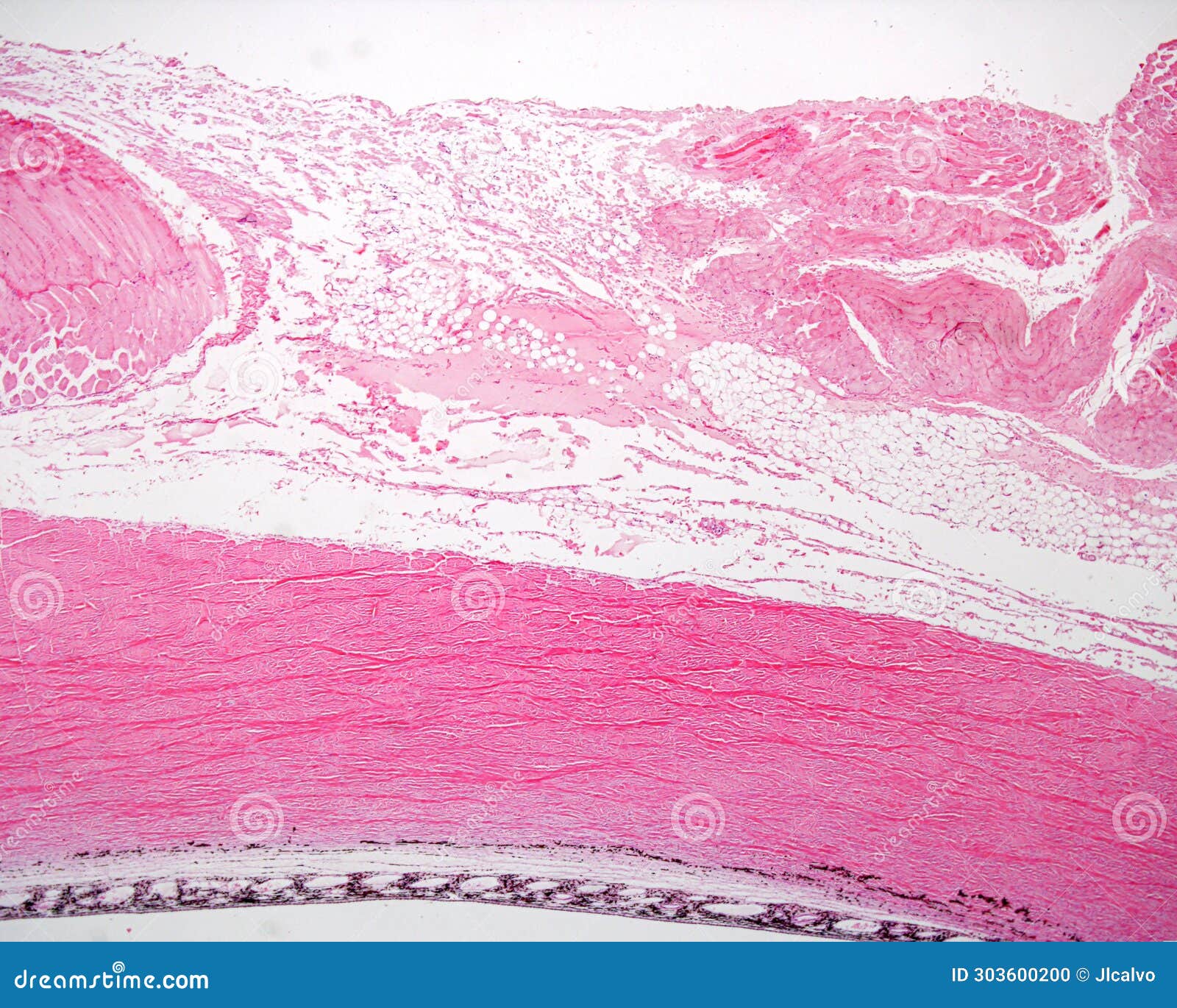 Eyeball wall stock photo. Image of microscopic, histological - 303600200