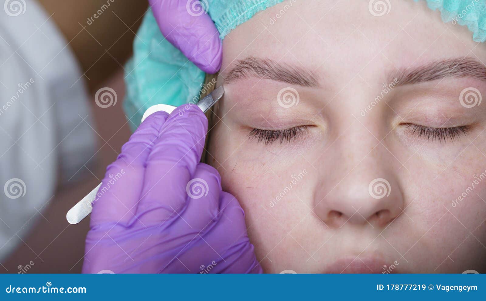 Eyebrow Correction Procedure Stock Image - Image of painless, model ...