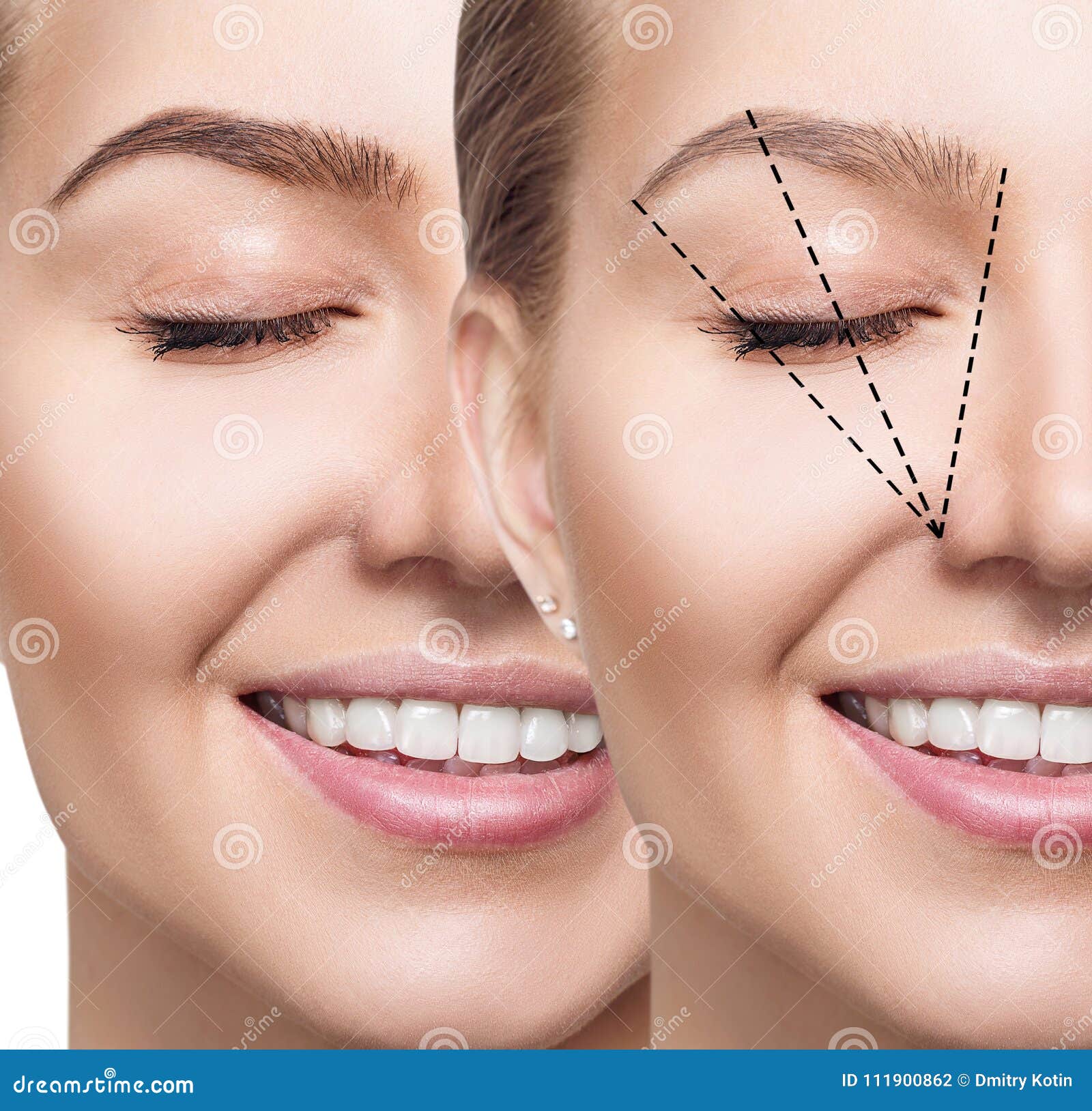 Female Face before and after Eyebrows Correction. Stock Photo - Image ...