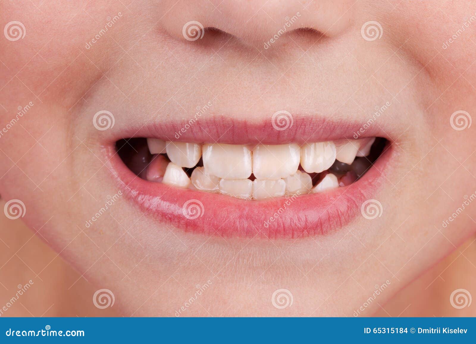 Face of a Child with an Open Mouth and Teeth Stock Photo - Image of ...