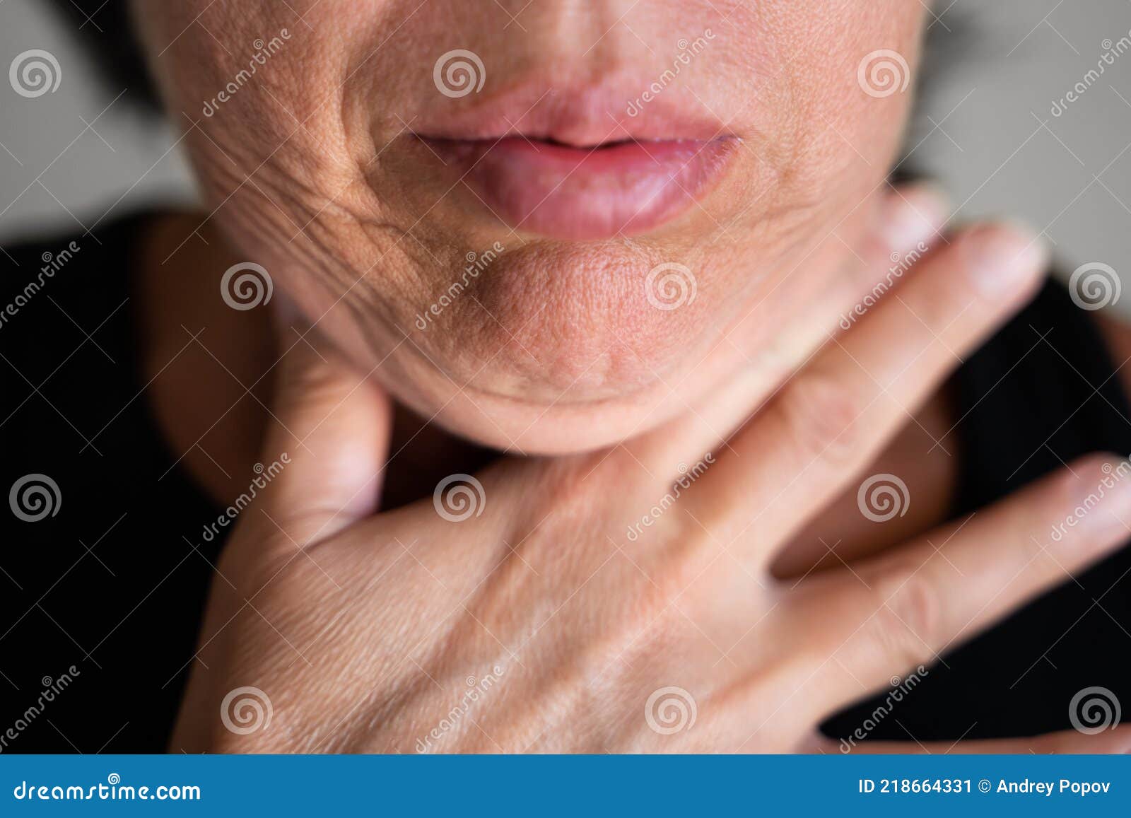 Double Chin Lift. Before And After Plastic Surgery, Mentoplasty Or Face ...