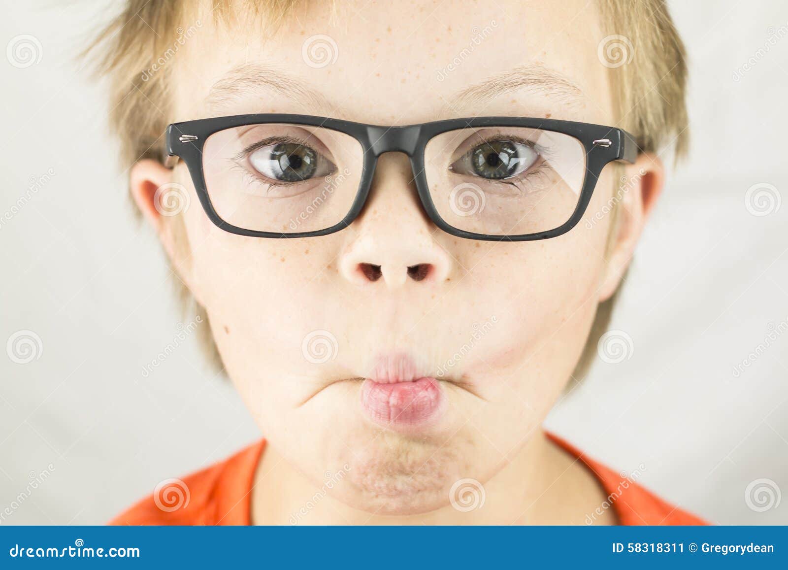 The Face of Downs Syndrome stock image. Image of brown - 58318311