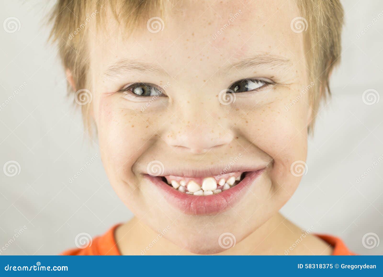 The Face of Downs Syndrome stock image. Image of downs - 58318375