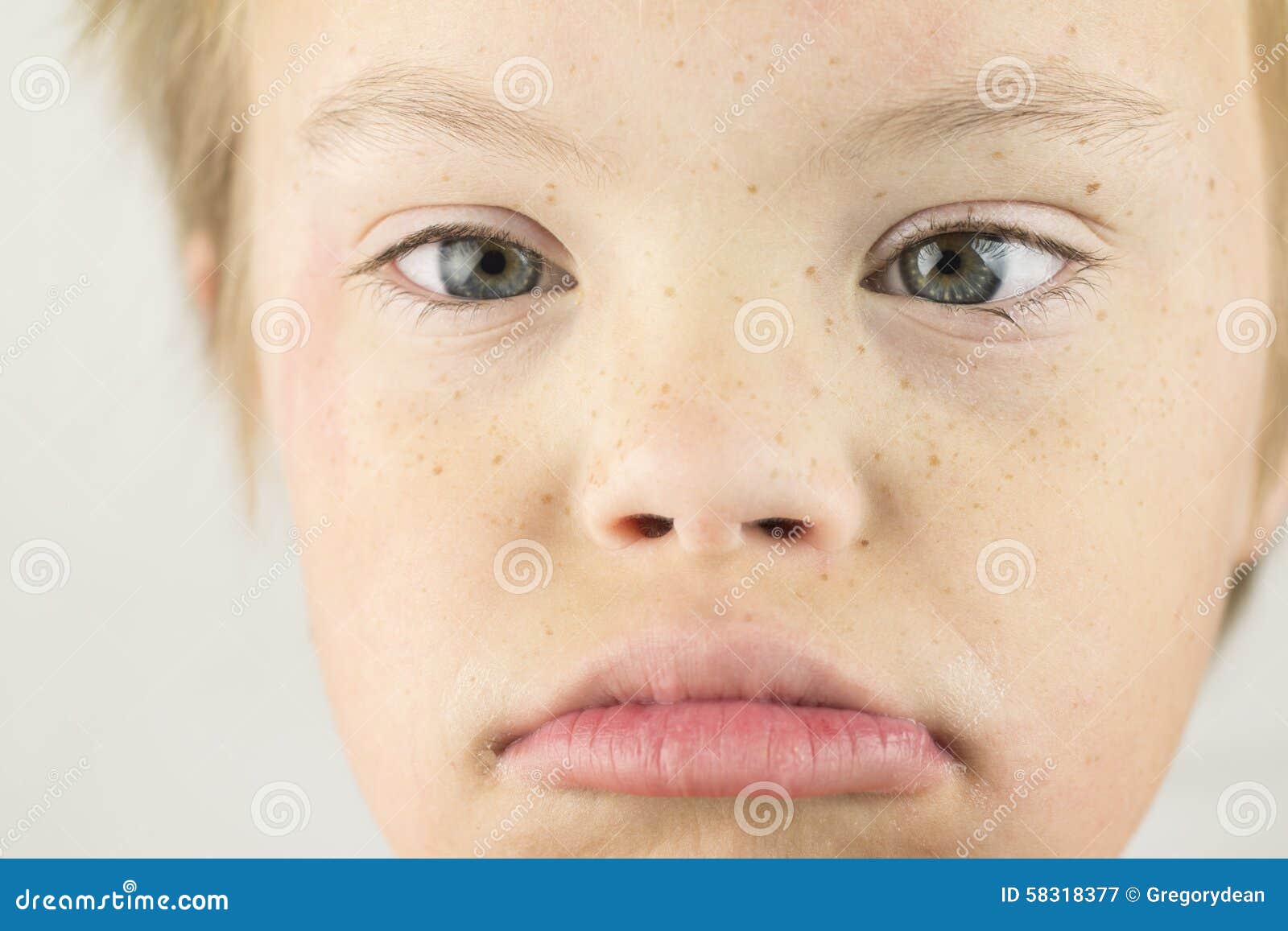 The Face of Downs Syndrome stock image. Image of downs - 58318377