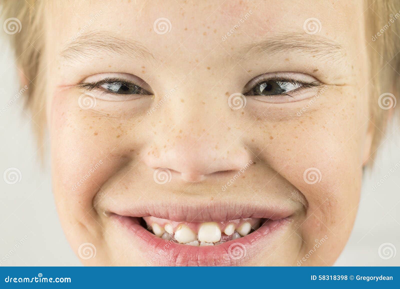 The Face of Downs Syndrome stock photo. Image of development - 58318398