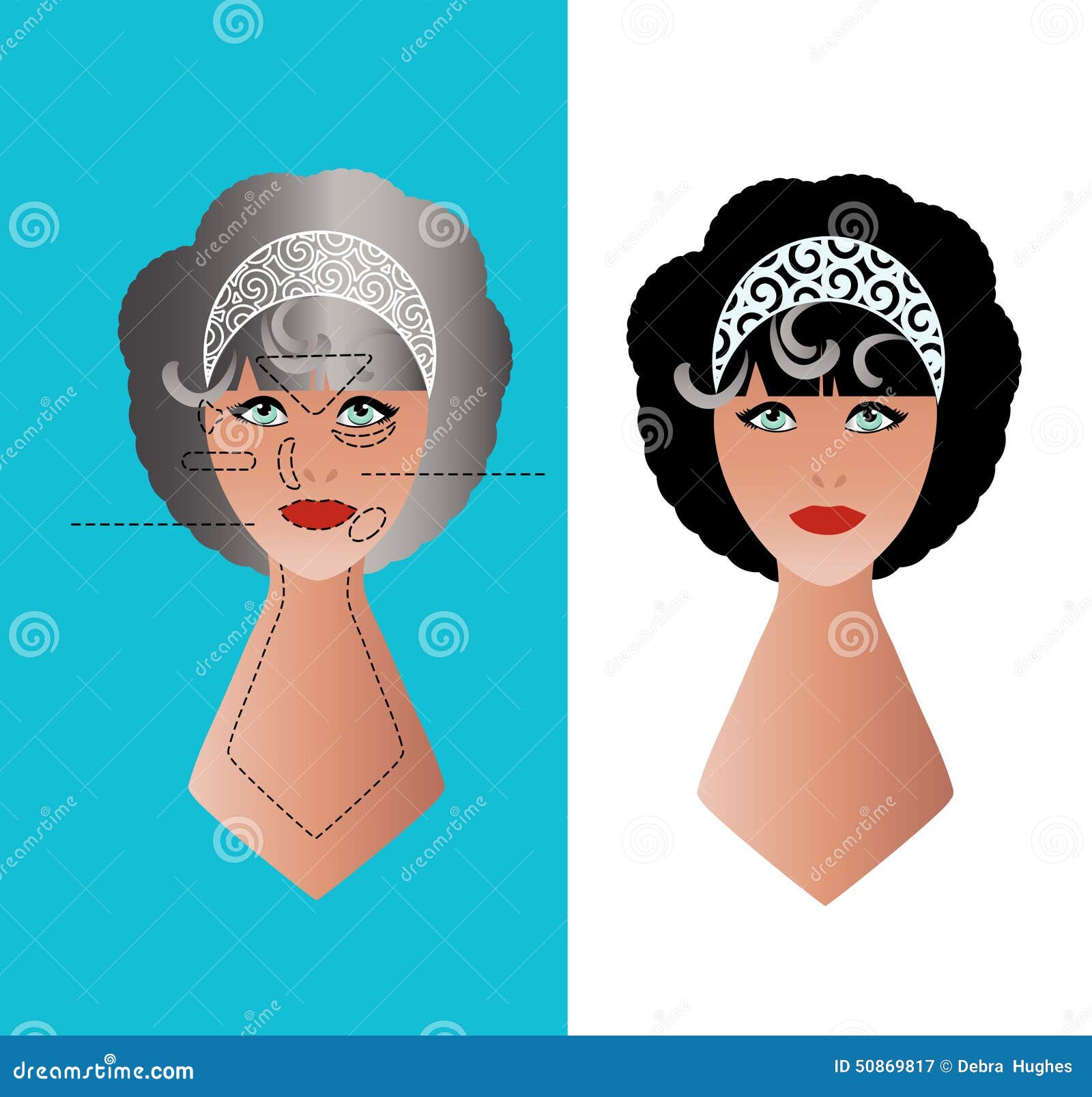 Face Injectables Facelift Cartoon Vector | CartoonDealer.com #50870889