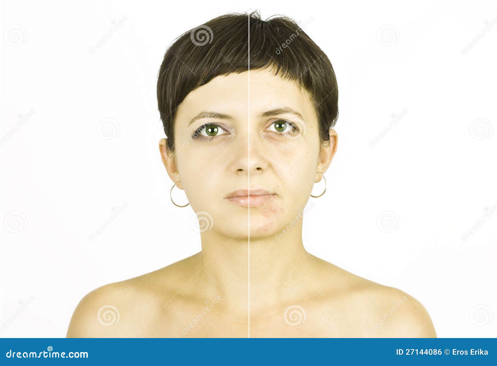 Face healing stock photo. Image of person, cheek, pores - 27144086