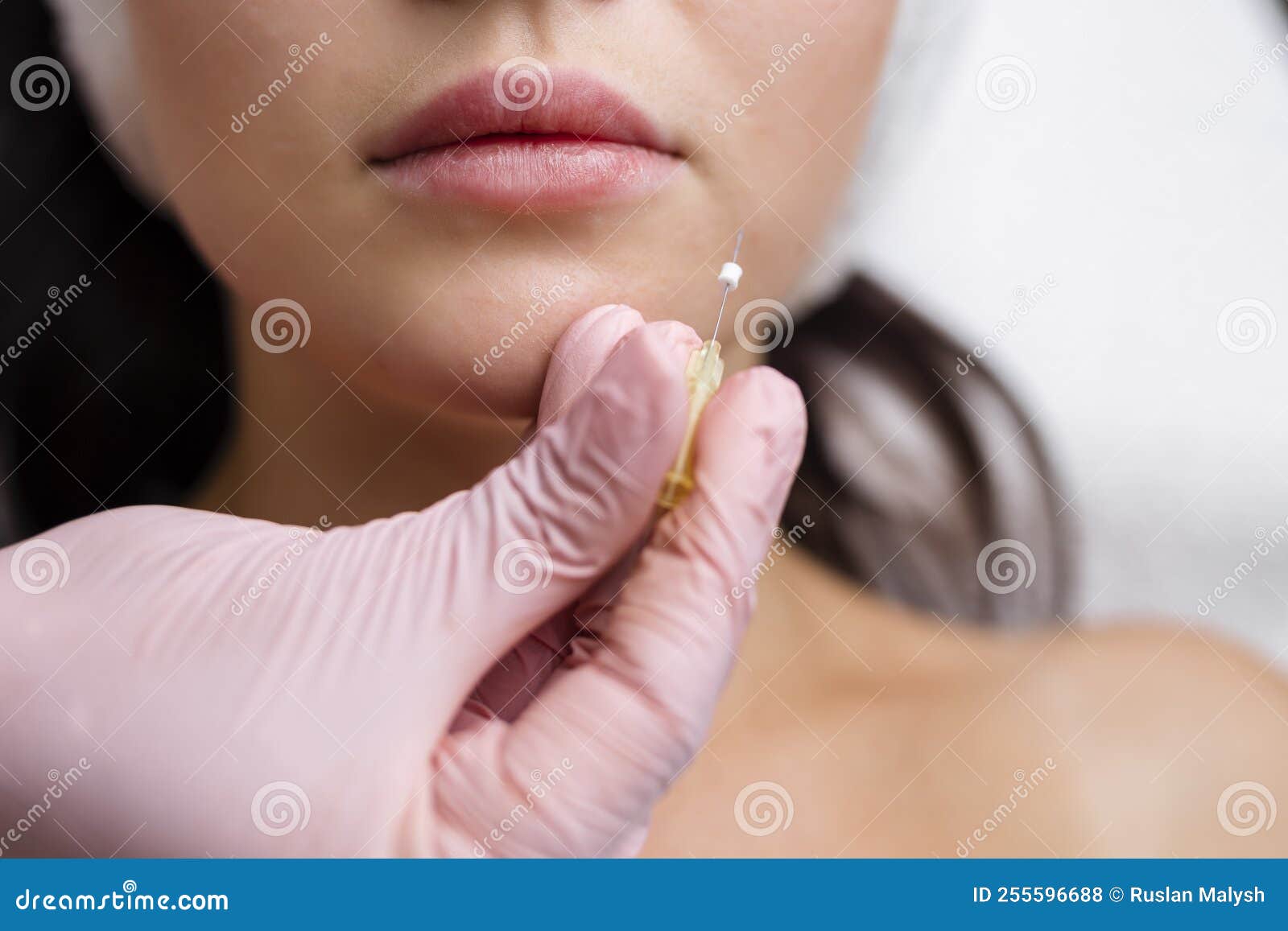 Face Lifting PDO Suture Operation. Innovative Technique of New Thread ...