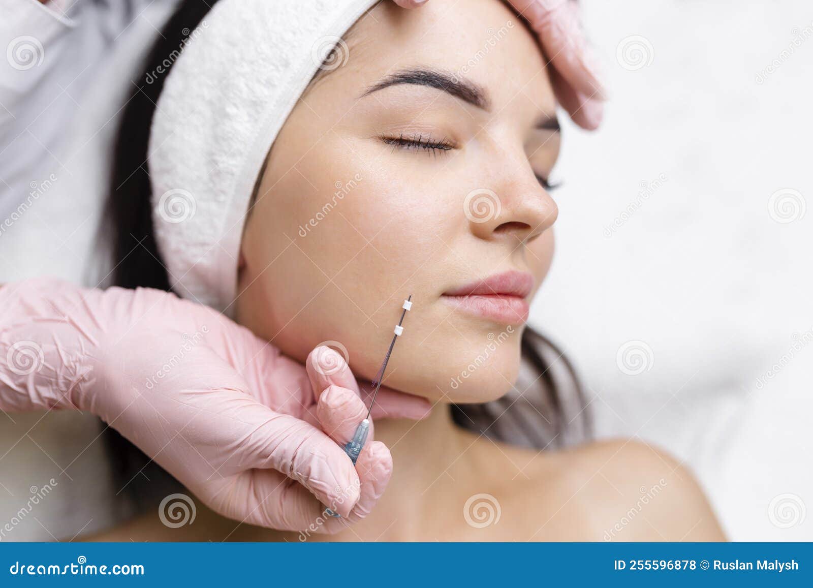 Face Lifting PDO Suture Operation. Innovative Technique of New Thread ...