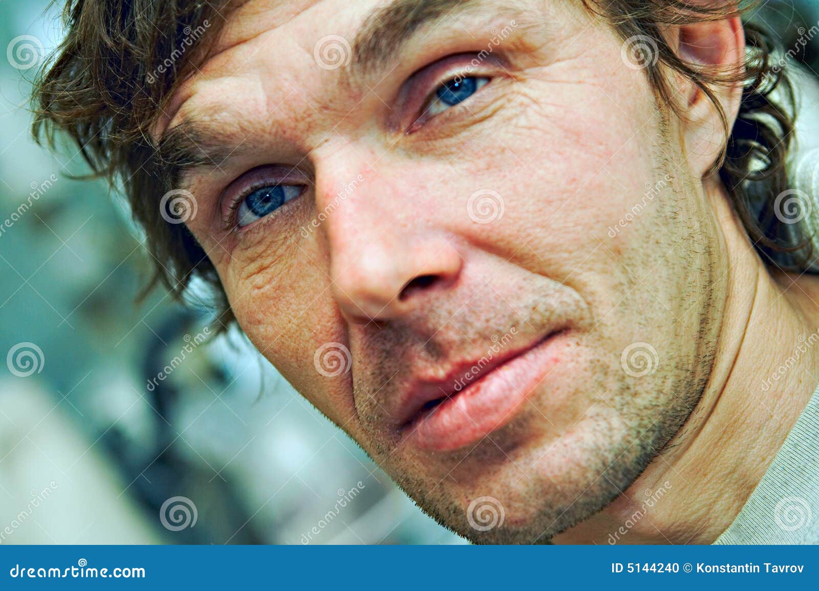 296 Edema Face Stock Photos - Free & Royalty-Free Stock Photos from ...