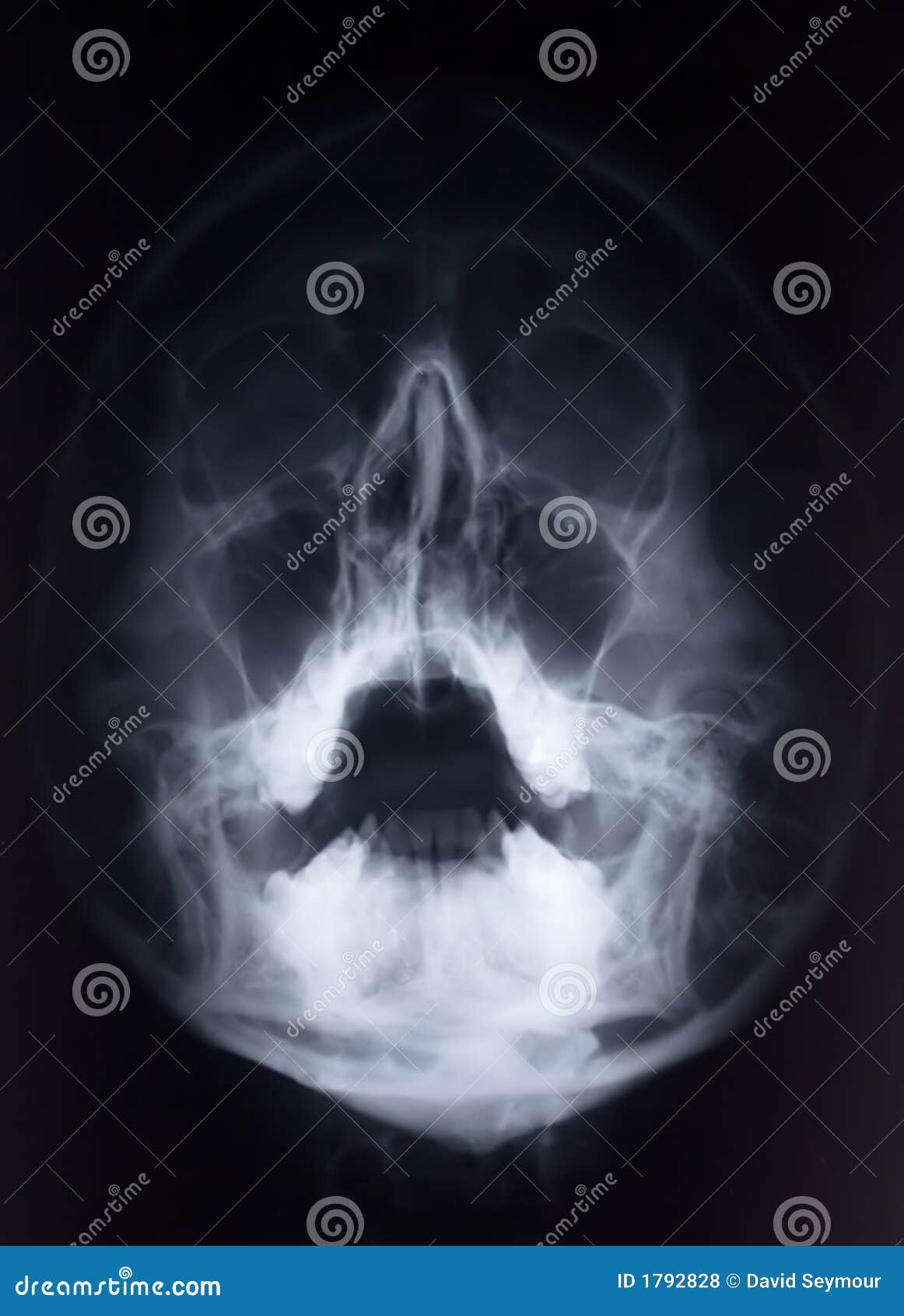 Face X-Ray stock photo. Image of mouth, bones, film, chin - 1792828