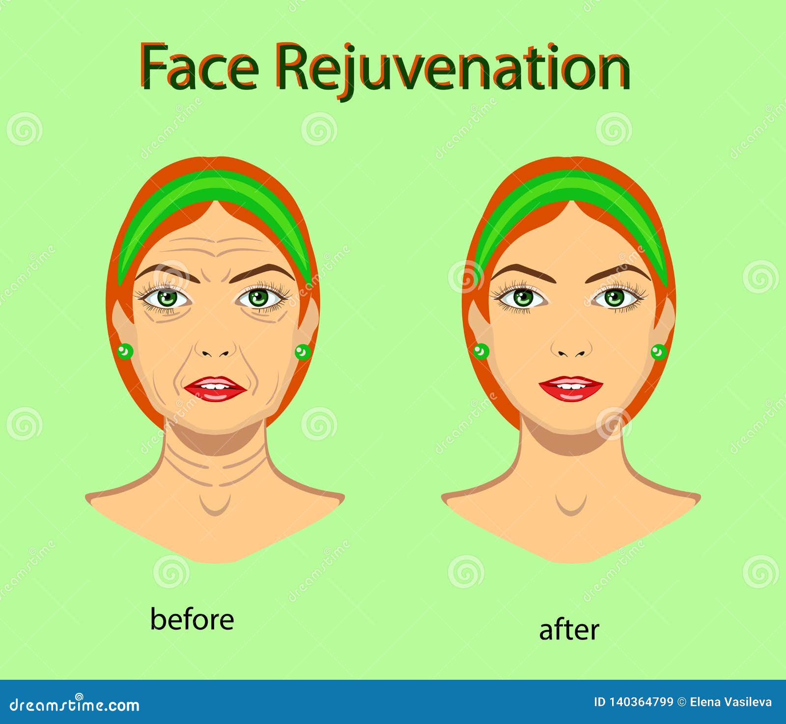 Face Rejuvenation, Vector Illustration with before after Effect Stock ...