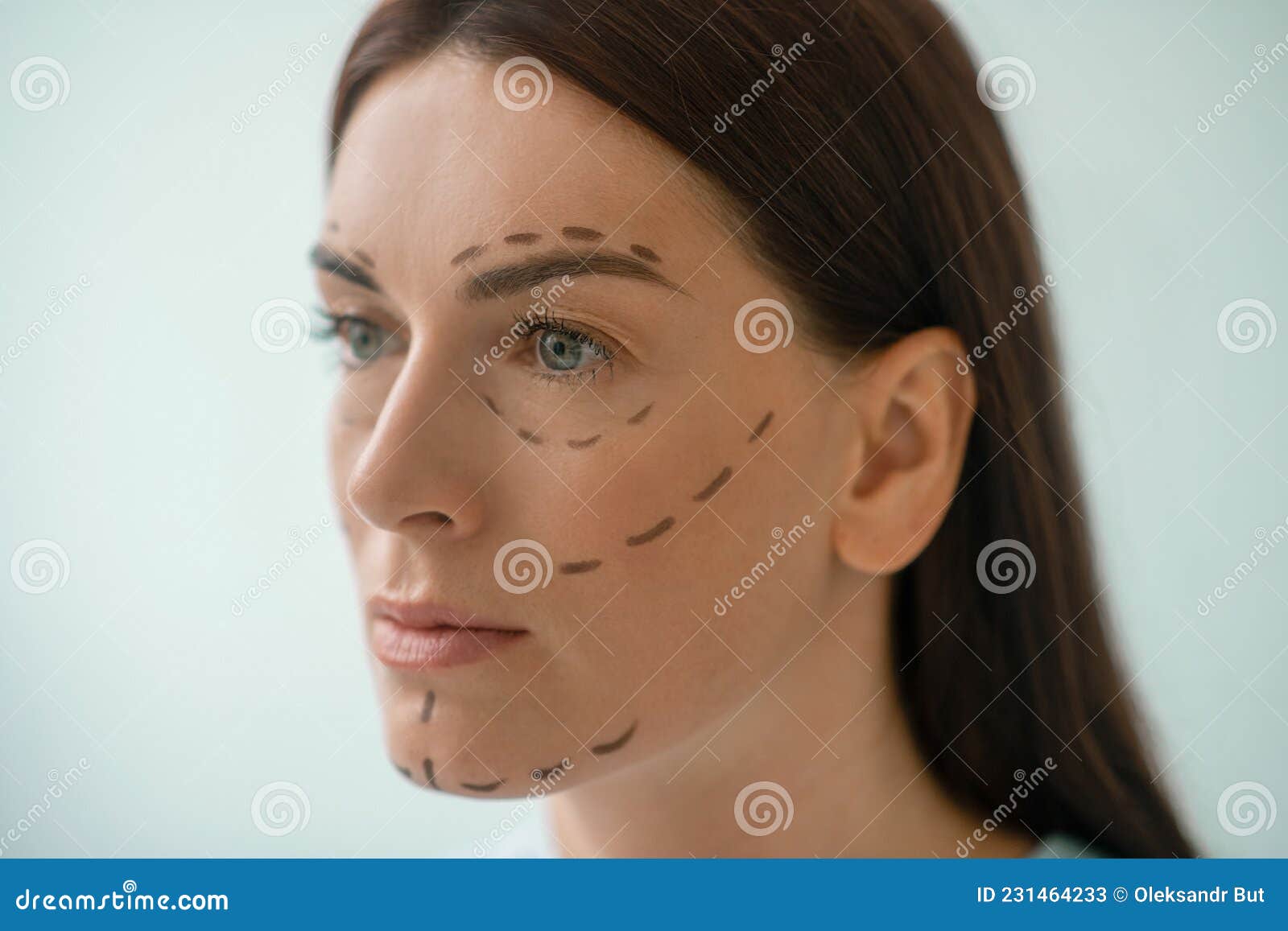 A Face of a Woman with Lines for Lifting Procedures Stock Image - Image ...