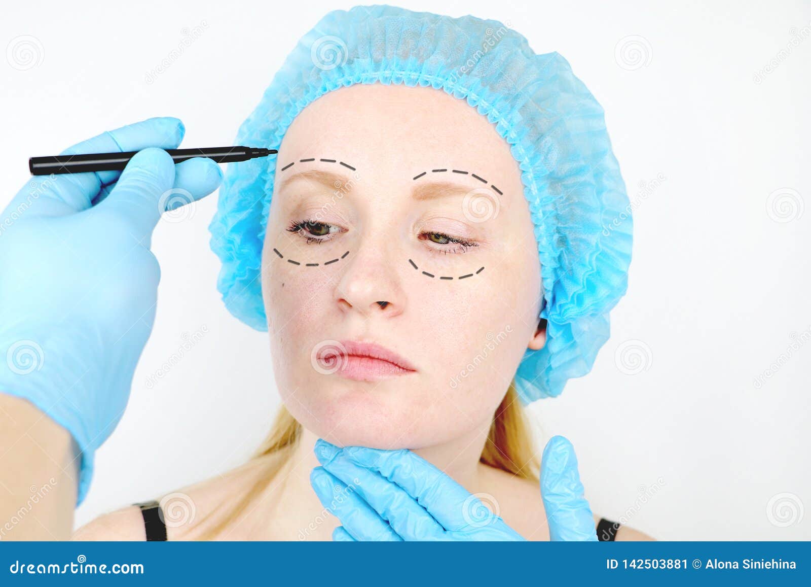 Facial Plastic Surgery or Facelift, Facelift, Face Correction. a ...