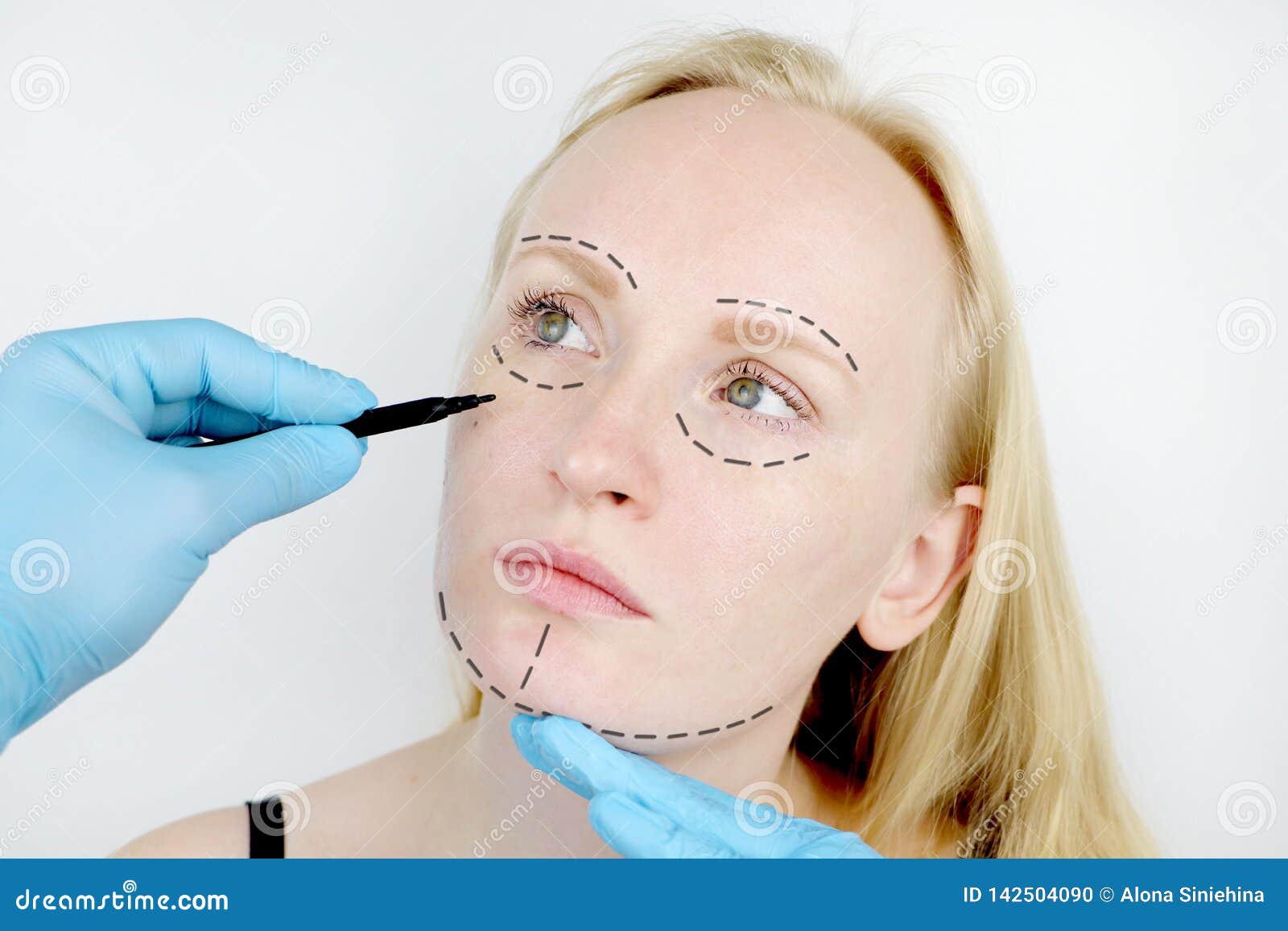 Facial Plastic Surgery or Facelift, Facelift, Face Correction. a ...