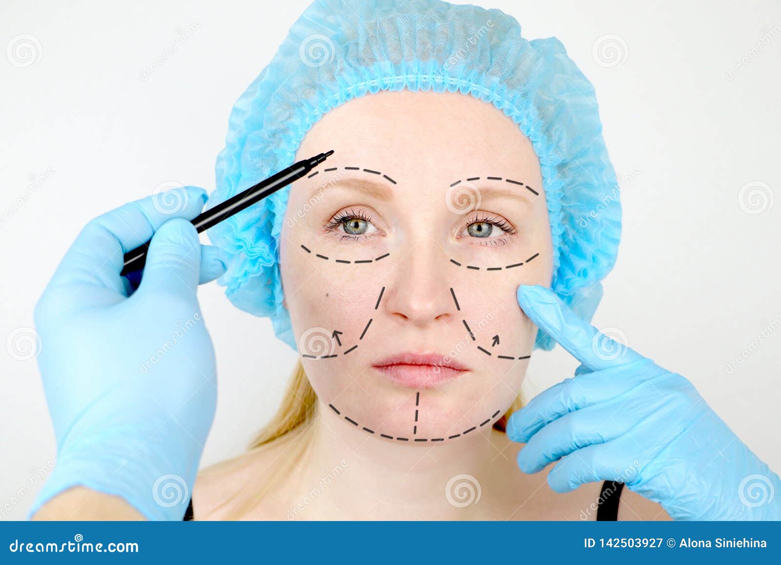 Facial Plastic Surgery or Facelift, Facelift, Face Correction. a ...