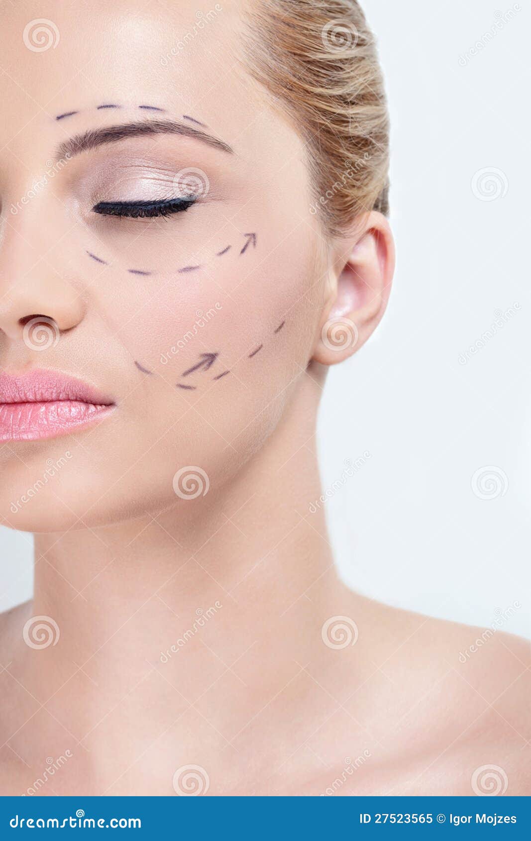 Facial surgery correction stock image. Image of care - 27523565