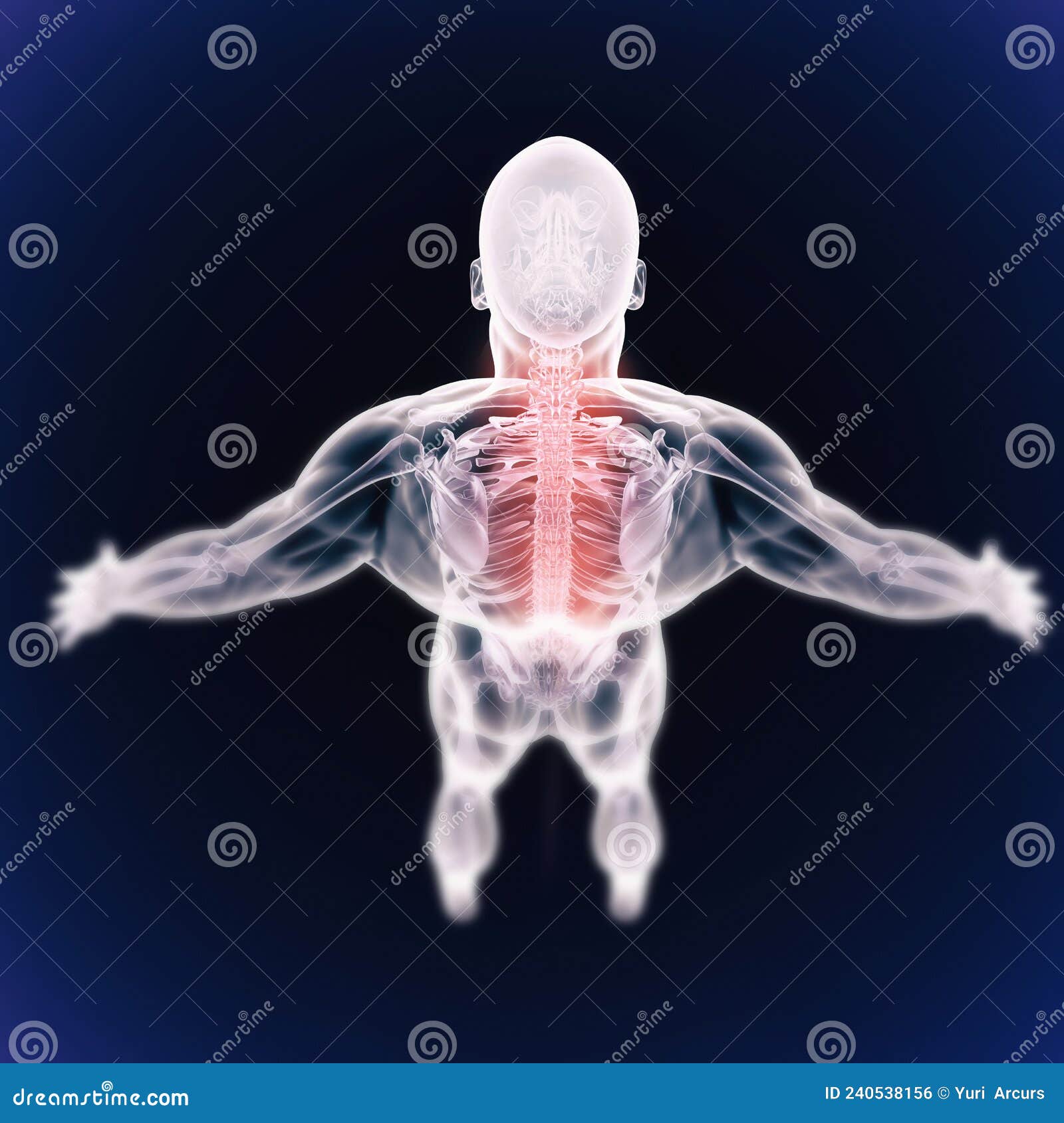Facing Crippling Inflammation and Pain. a High Angle View of a Cgi ...